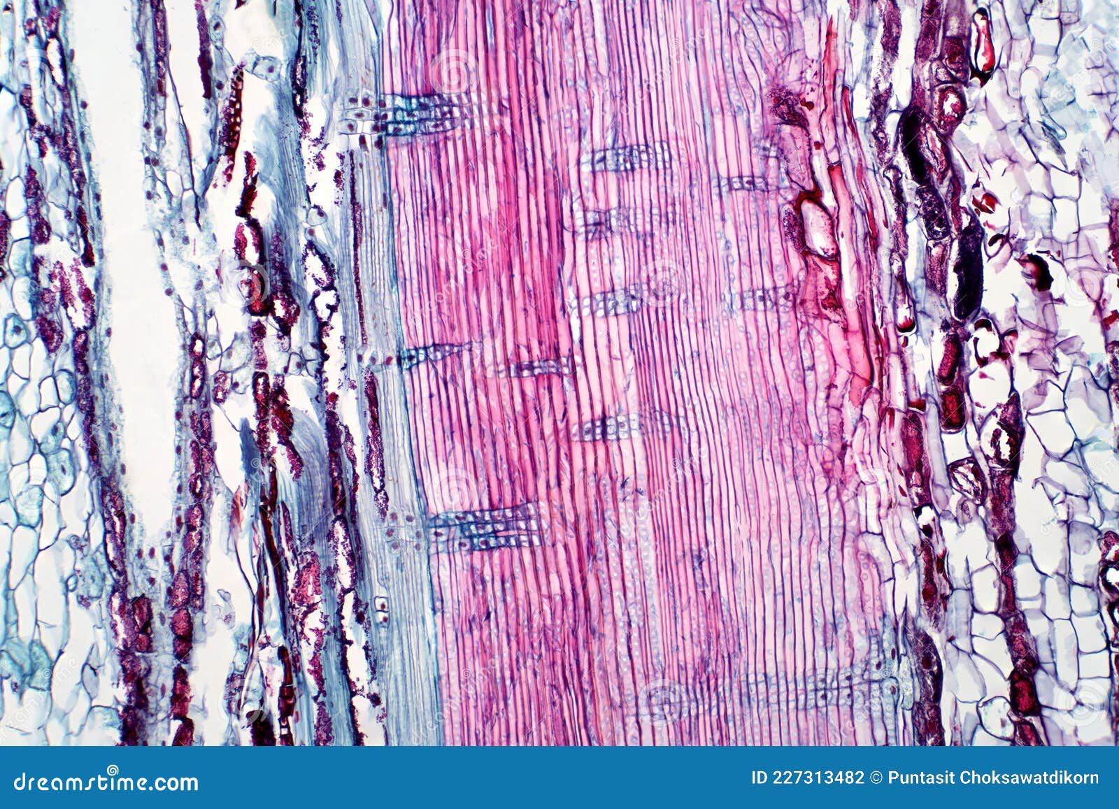 Plant Vascular Tissue Under The Light Microscope View Stock Photography ...