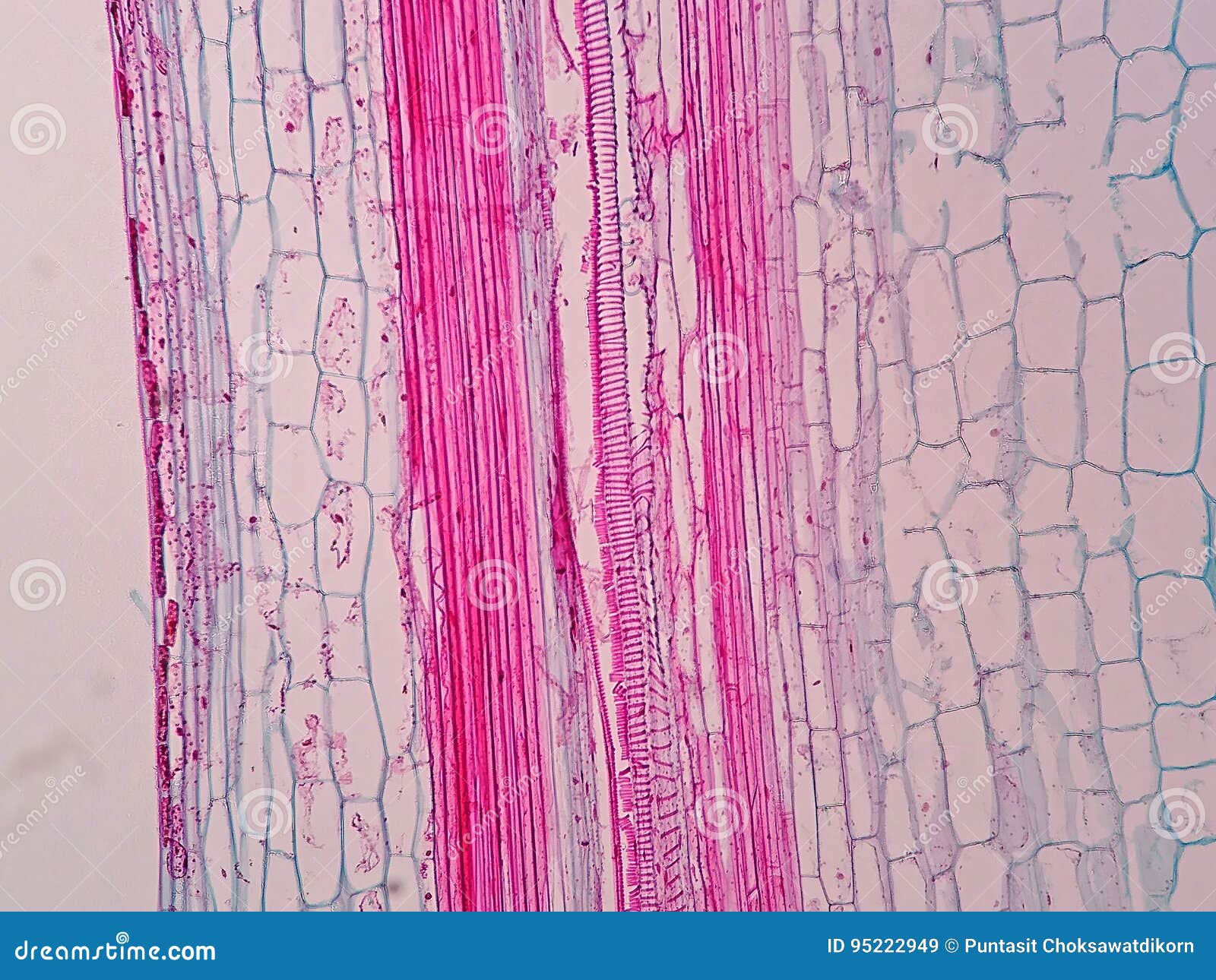 Human Vascular Tissue Labeled