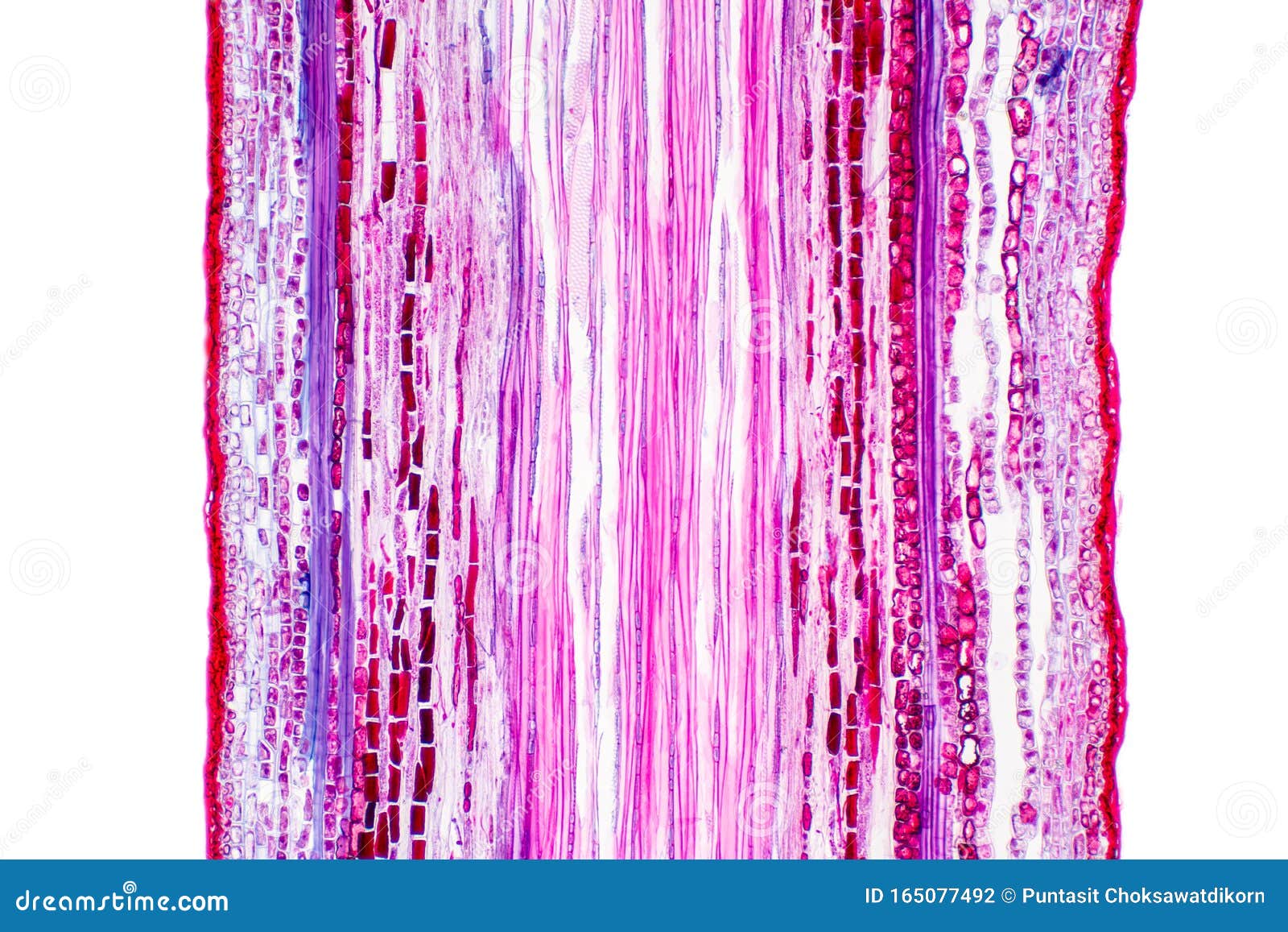 Plant Vascular Tissue Under the Microscope View Stock Photo - Image of ...