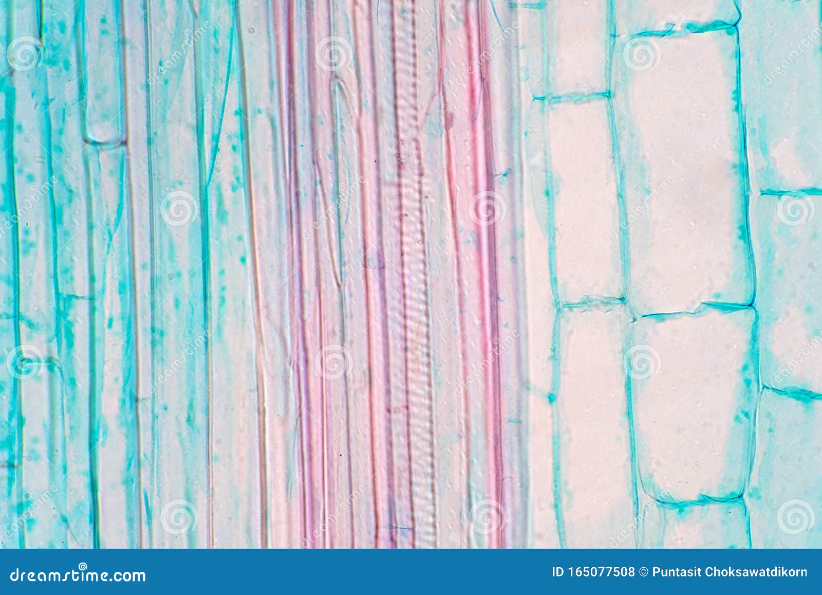Plant Vascular Tissue Under the Microscope View Stock Photo - Image of ...