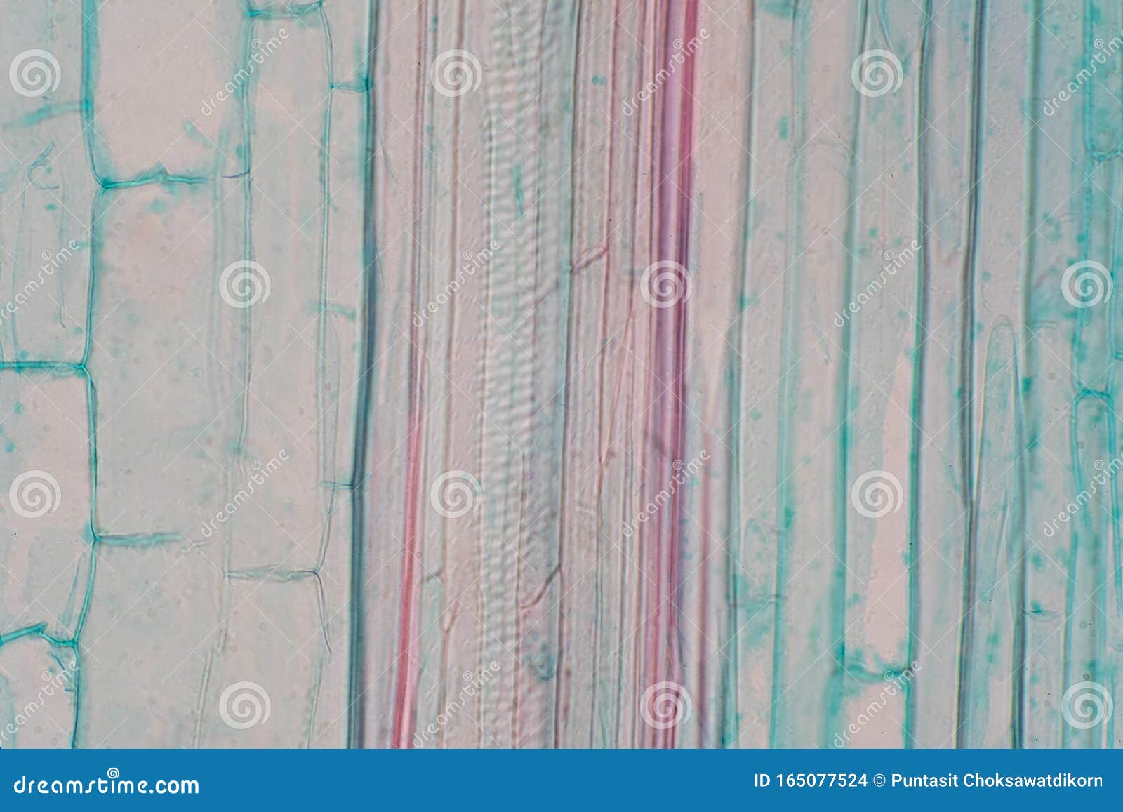 Plant Vascular Tissue Under the Microscope View Stock Photo - Image of ...