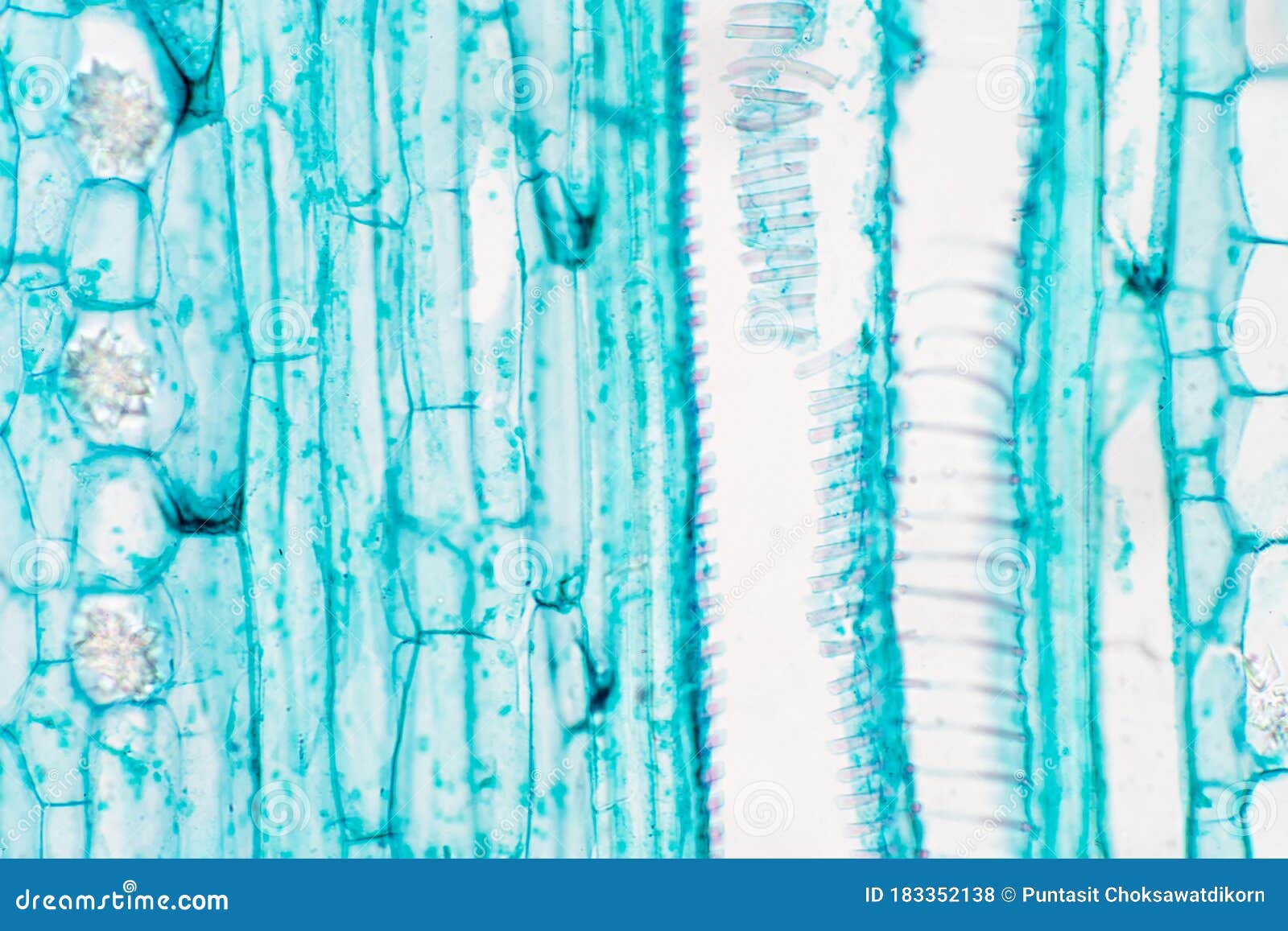 Plant Vascular Tissue Under the Microscope View Stock Photo - Image of ...