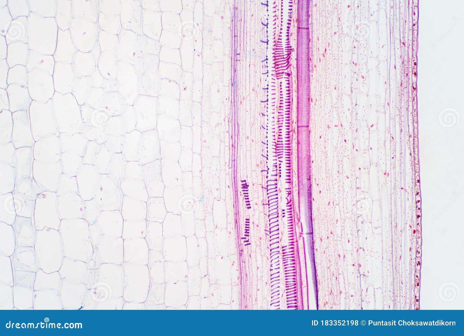 Plant Vascular Tissue Under the Microscope View Stock Photo - Image of ...