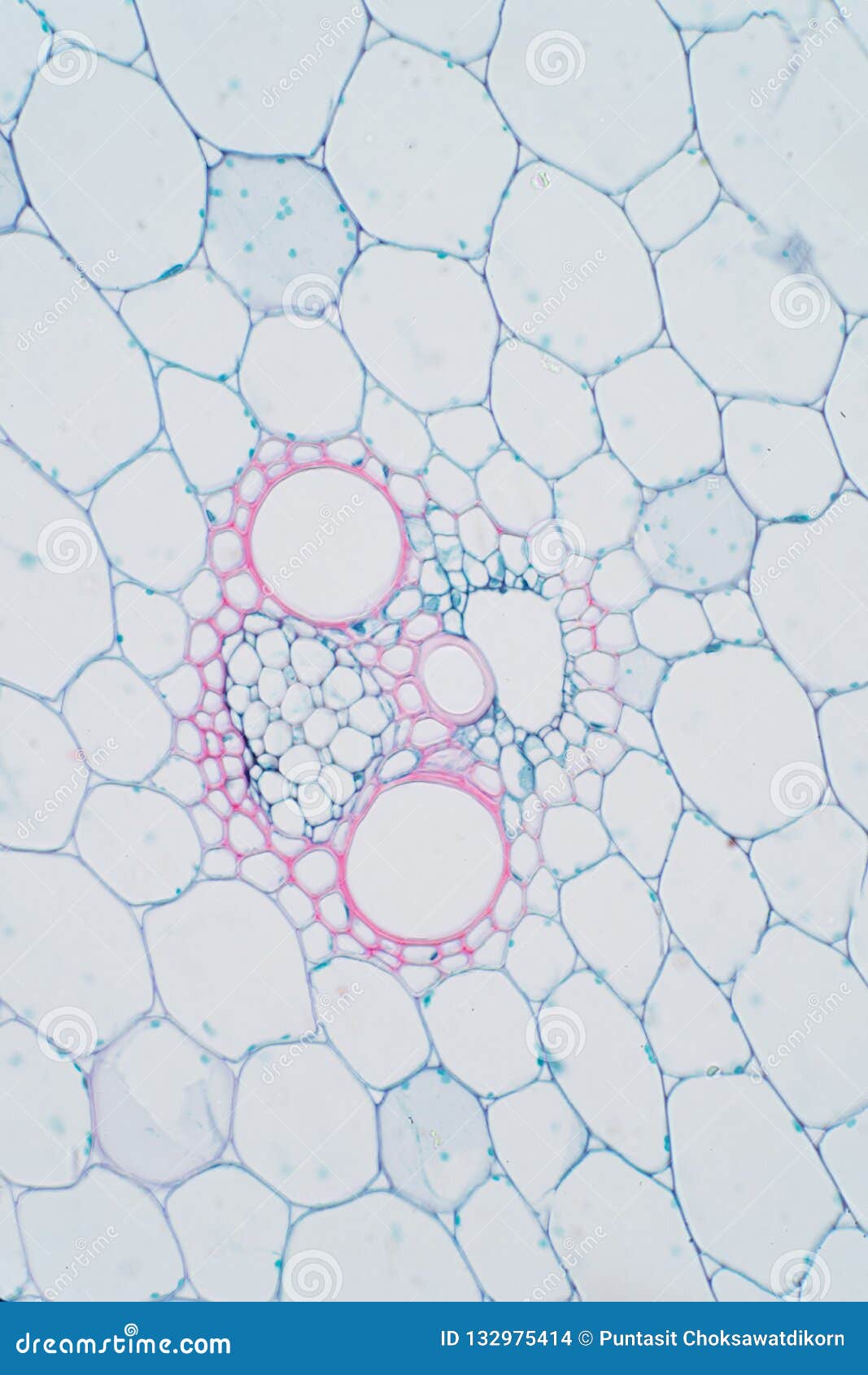 Plant Vascular Tissue Under Microscope View Stock Photo - Image of ...