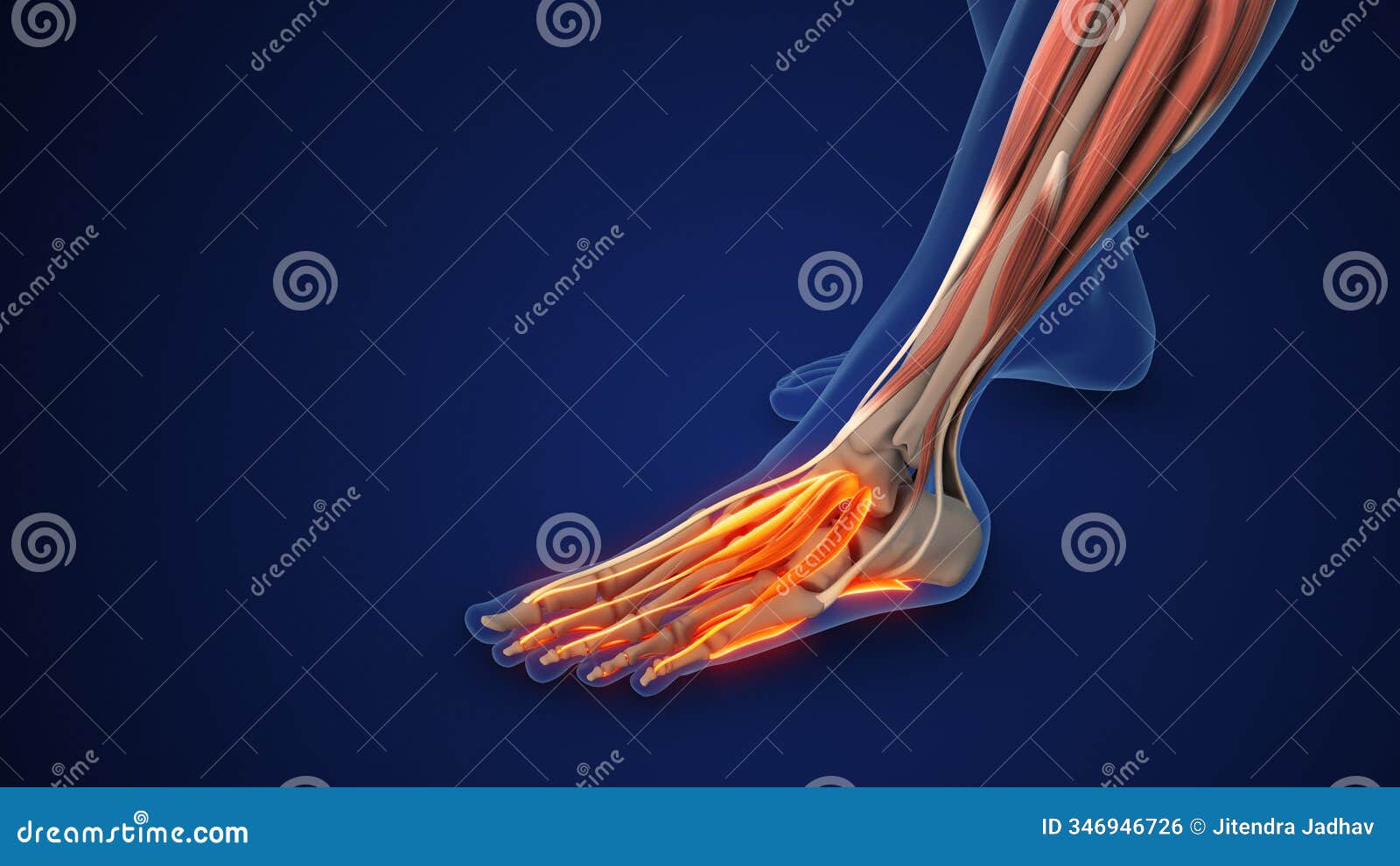 Plantar Fascia Tissue Overload Dysfunction Disorder Stock Image 331527223
