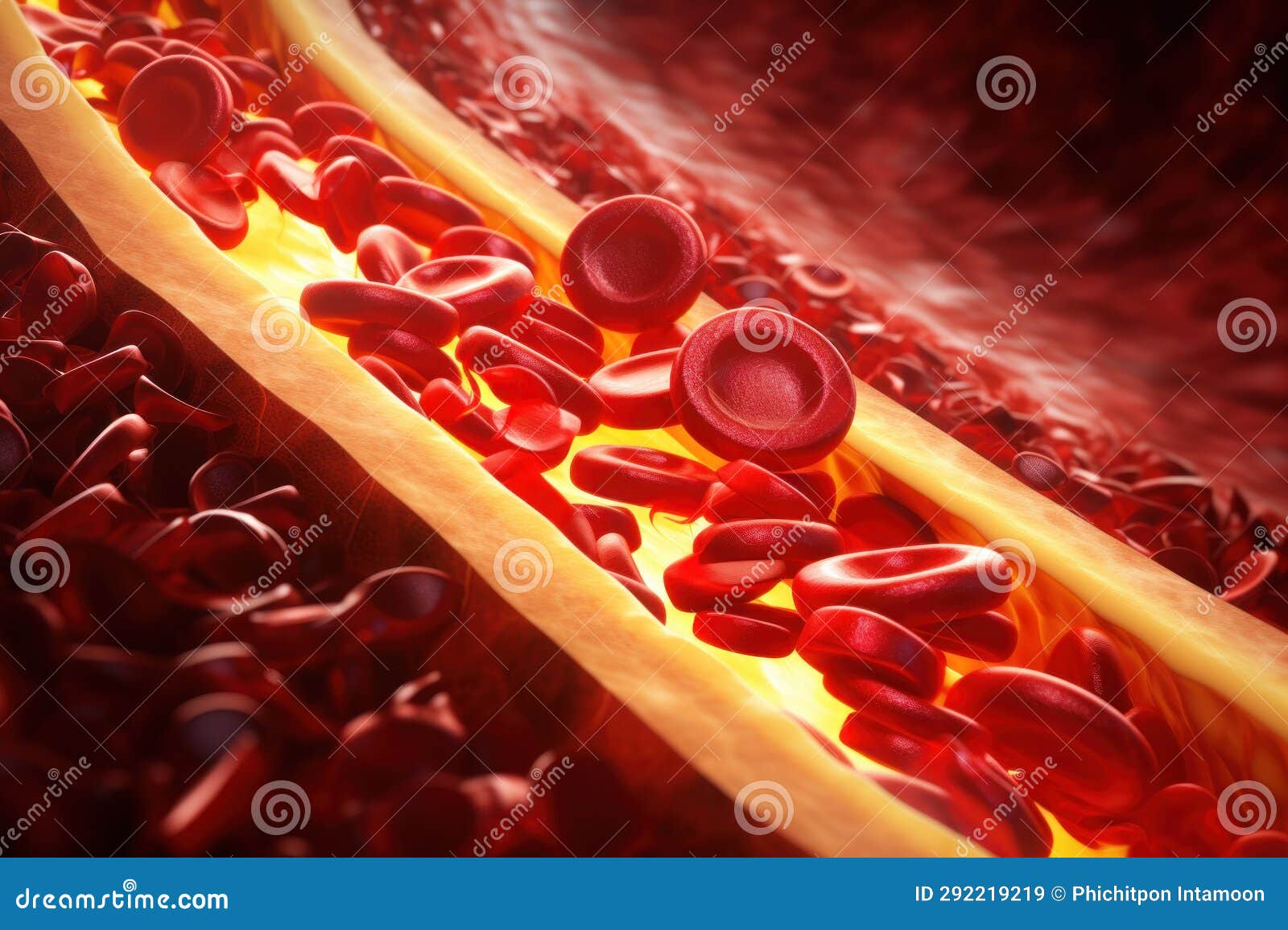 Plaque Buildup: Blocked Vein or Artery - Generative AI Stock Image ...