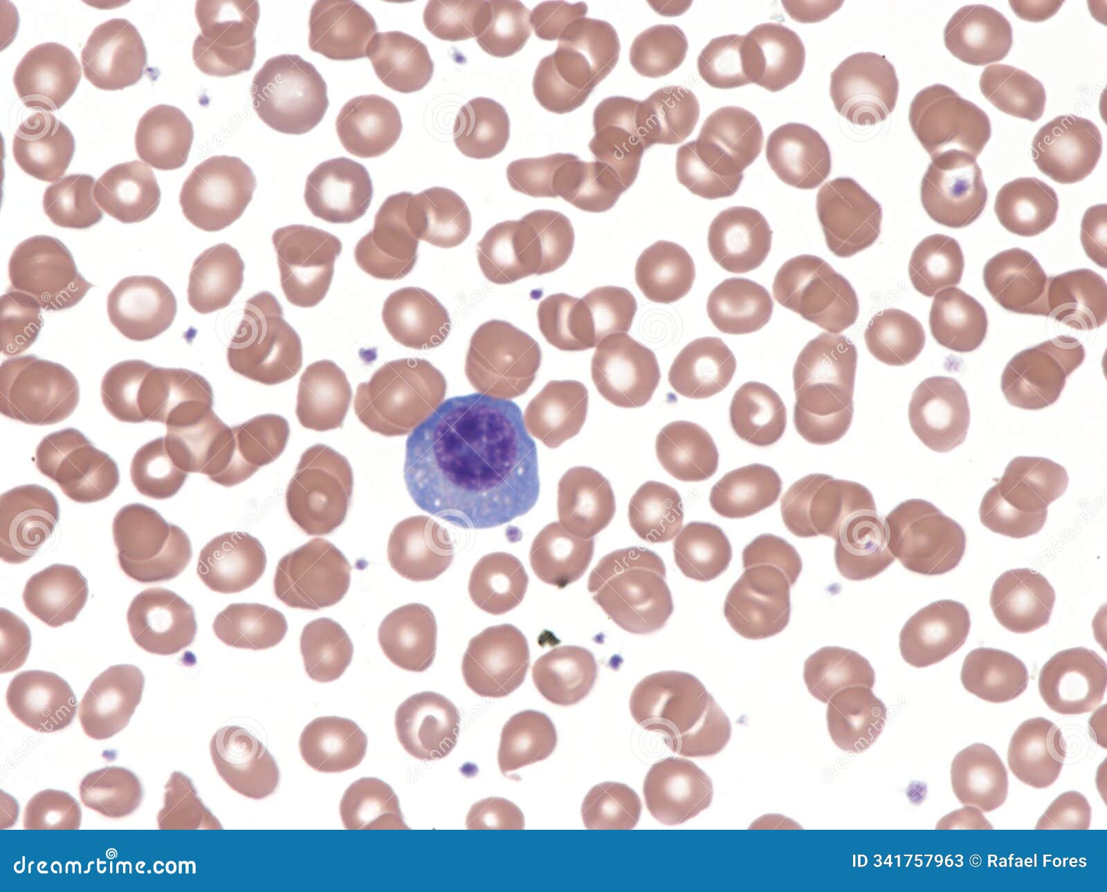 Plasma Cell TS Royalty-Free Stock Photo | CartoonDealer.com #84220191