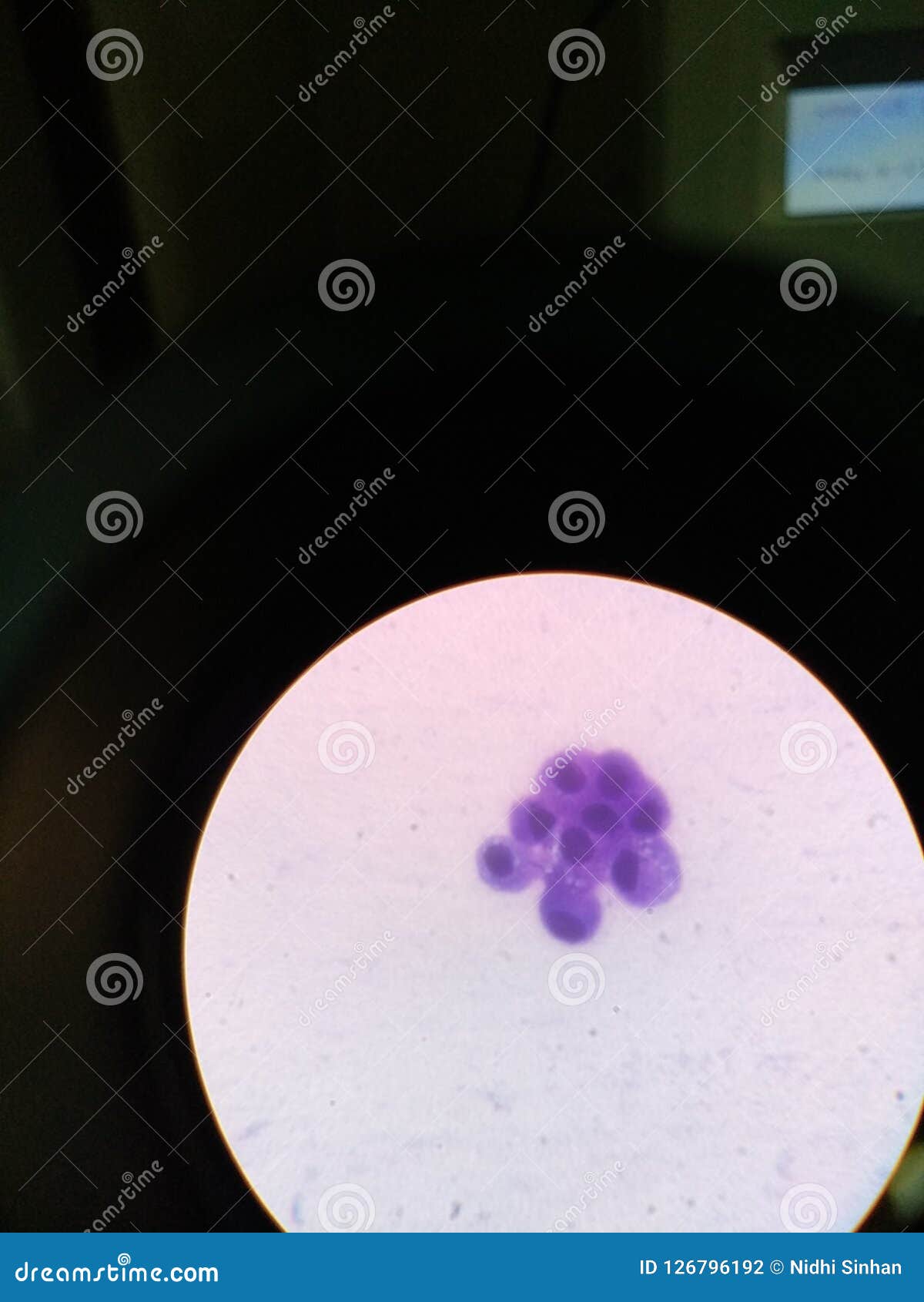 Plasma cell stock photo. Image of plasma, cells, cell - 126796192