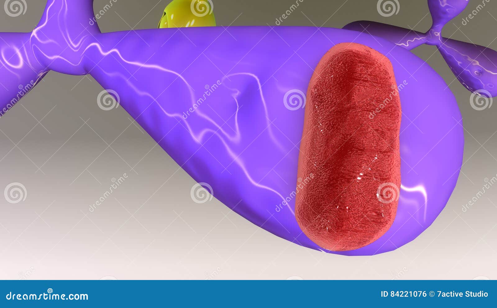 Lymphocyte . White Blood Cells With Transparency Membrane And Large ...