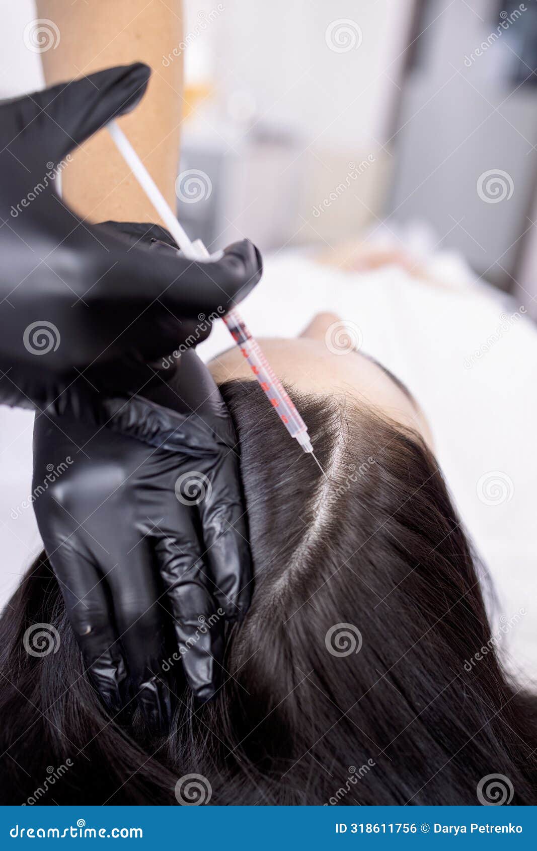 Plasmolifting or PRP Method Point the Introduction of the Patient S Own ...