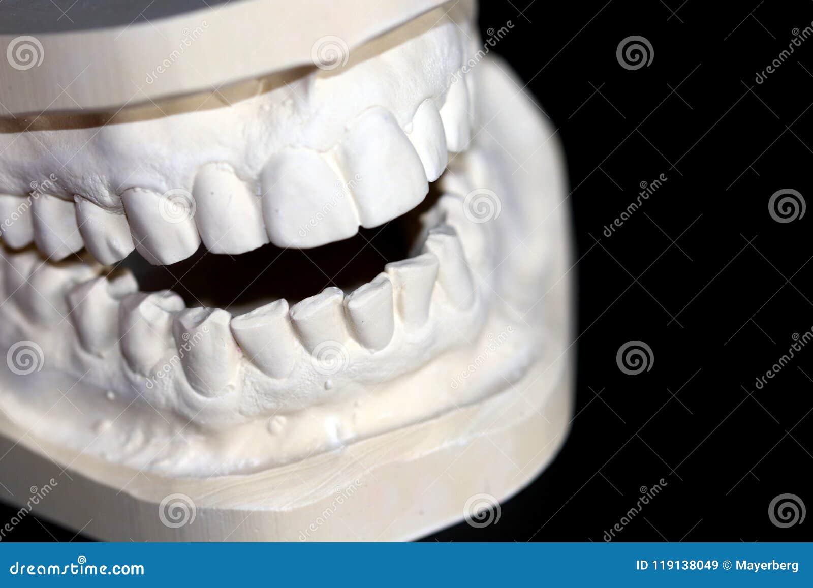 Plaster Cast from Above and Lower Teeth of Human Stock Image - Image of ...