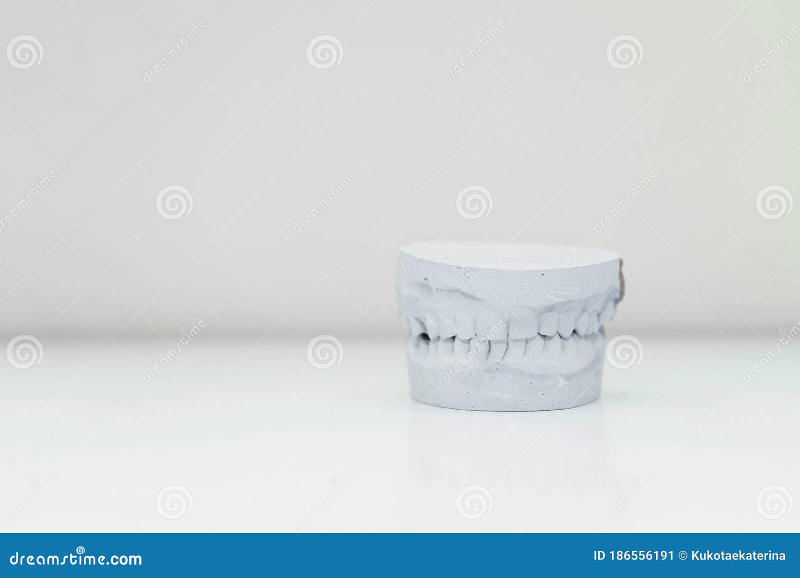 Plaster Cast of the Jaw on a Table in a Bright Room Stock Image - Image ...