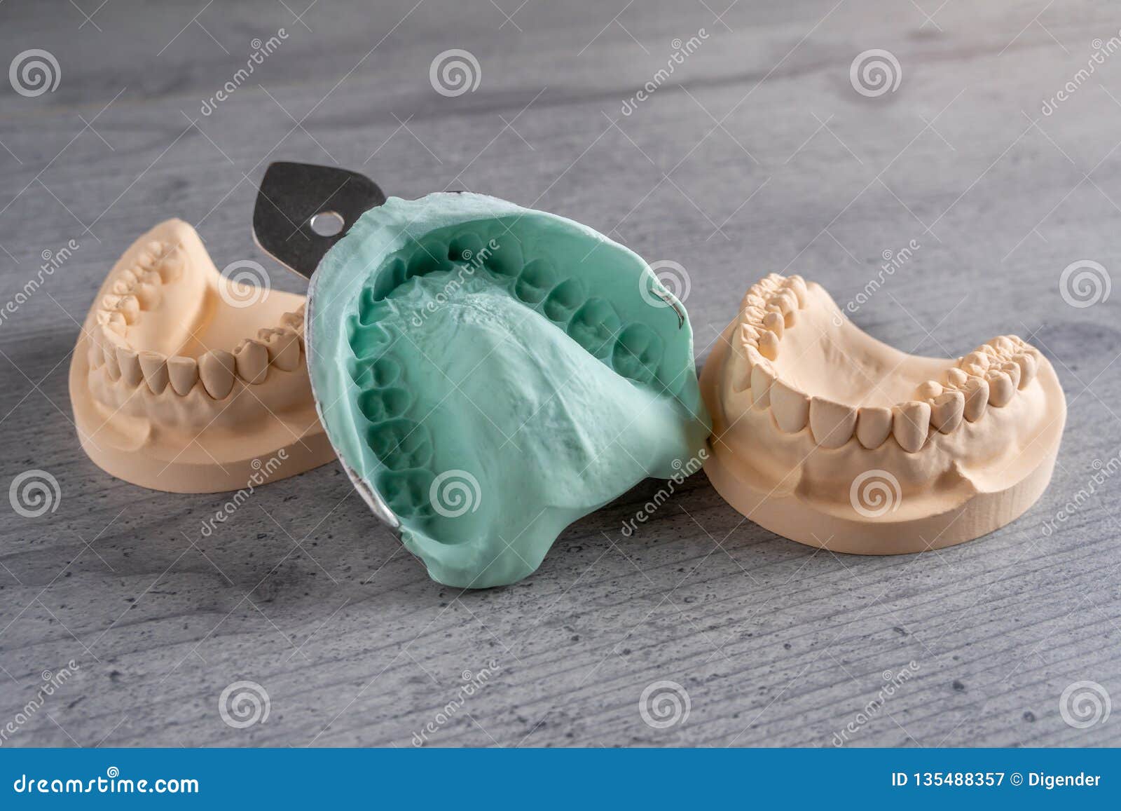 Plaster Cast Molds of the Upper and Lower Jaws Stock Image - Image of ...