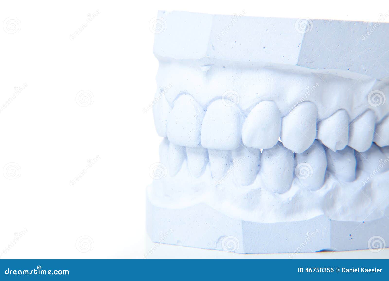 Plaster Cast of Perfect Teeth Stock Photo - Image of perfect, dental ...