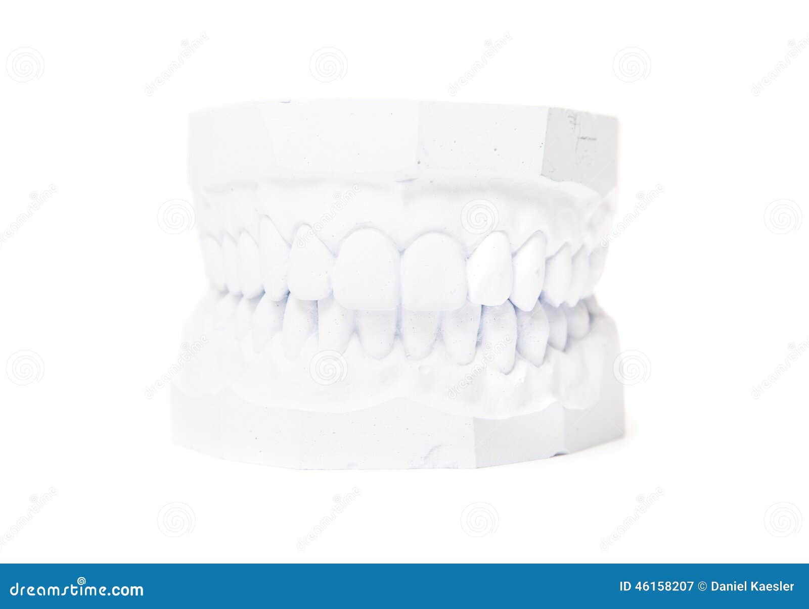 Cast Of Teeth Isolated On White Background. Denture, Close Up Royalty ...