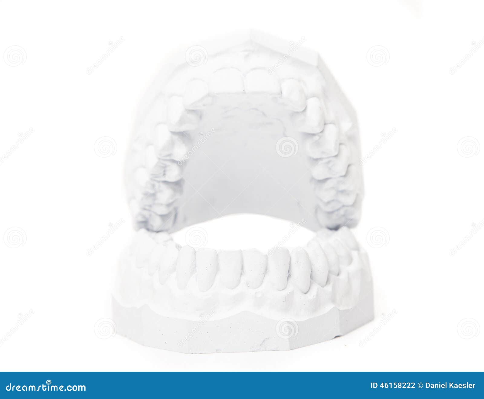 Plaster cast of teeth stock photo. Image of teeth, issues - 46158222