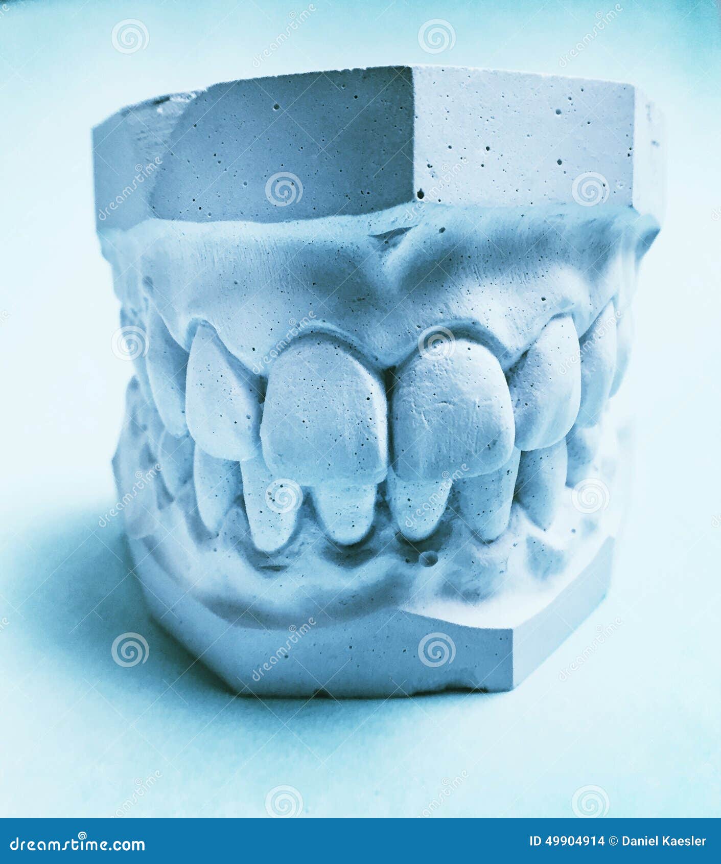 Plaster cast of teeth stock photo. Image of dental, blue - 49904914
