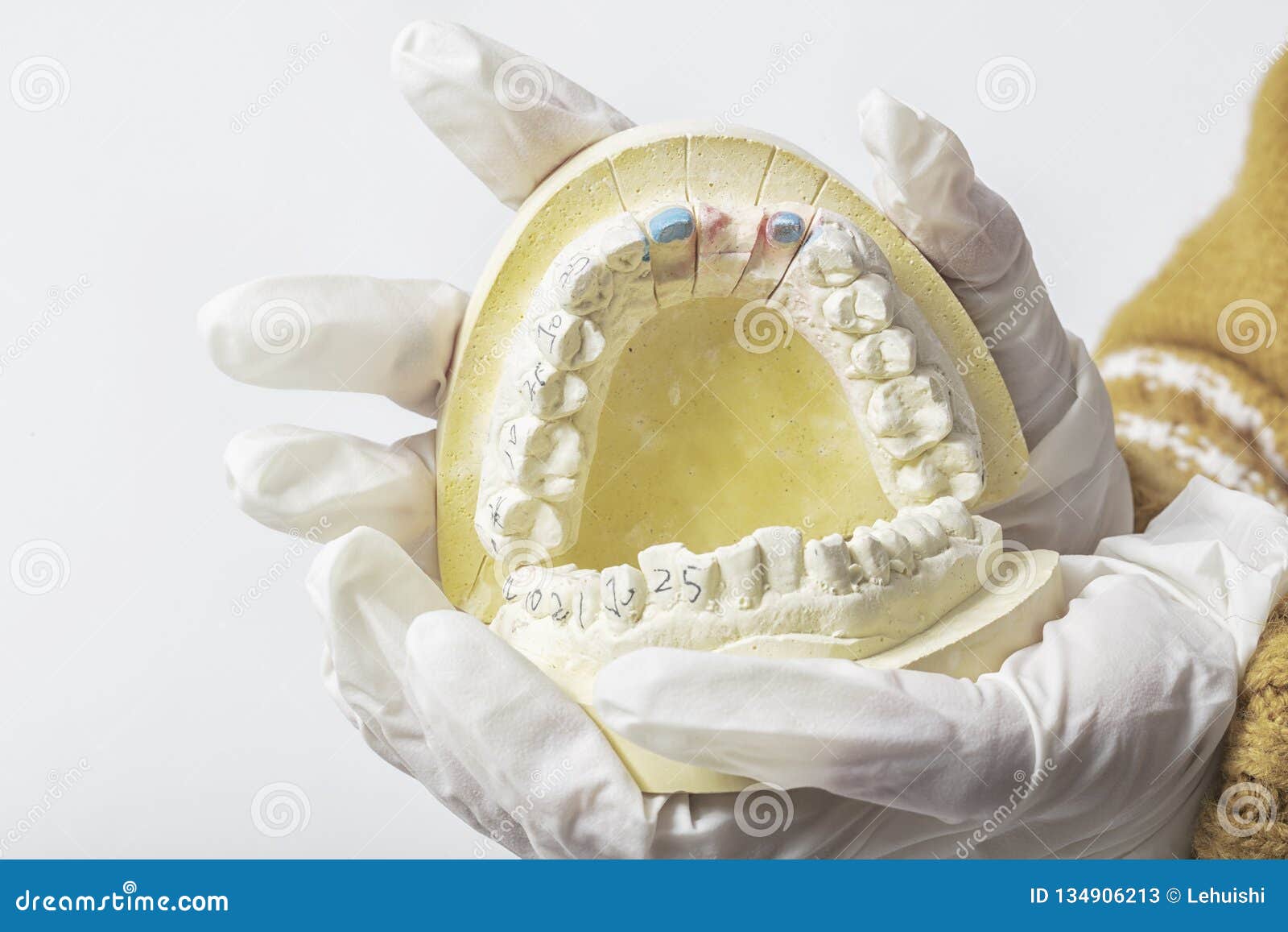 Plaster Cast of Teeth in the Hand Stock Image - Image of care, healthy ...