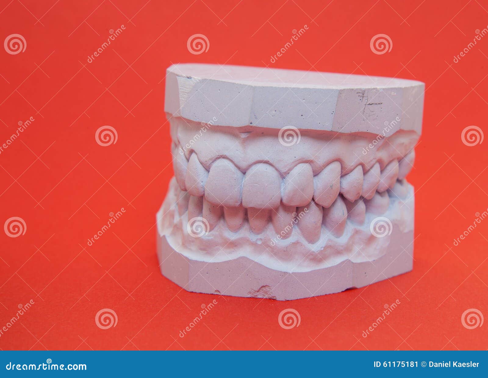 Plaster cast of teeth stock image. Image of treatment - 61175181