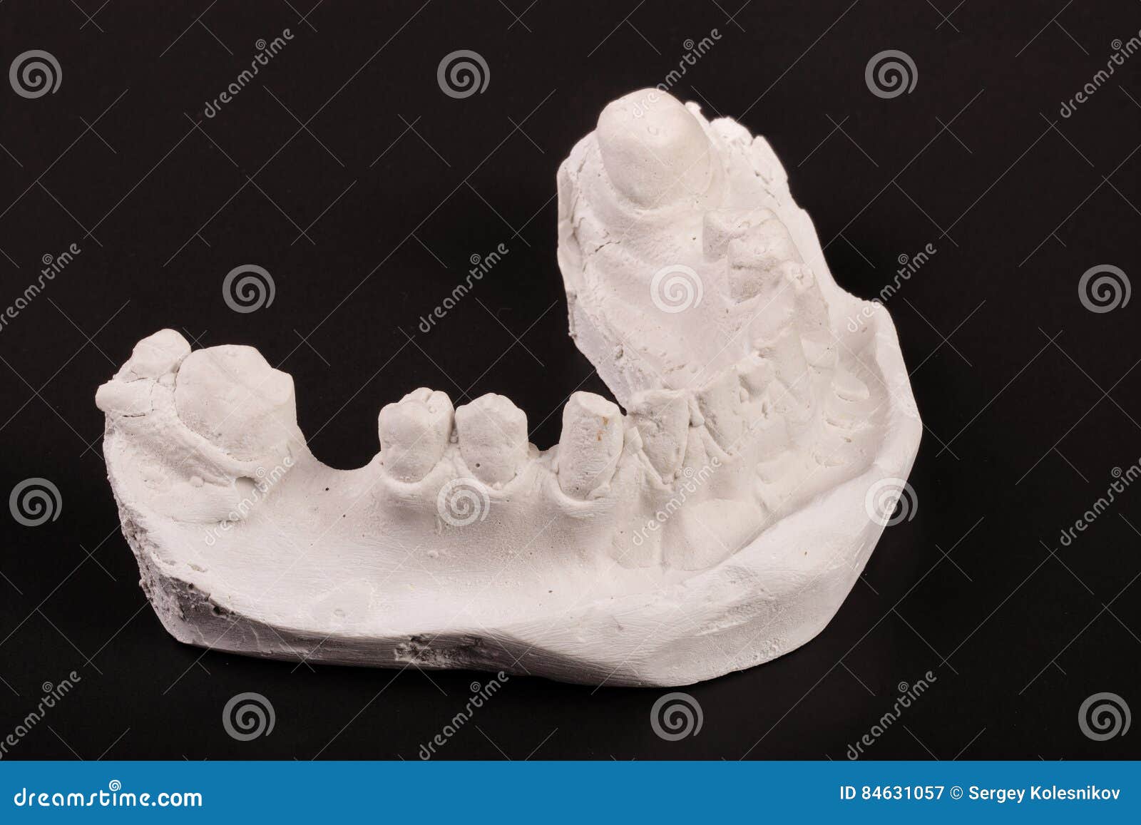 Plaster Cast of Teeth with Removable Partial Denture on a Dark ...