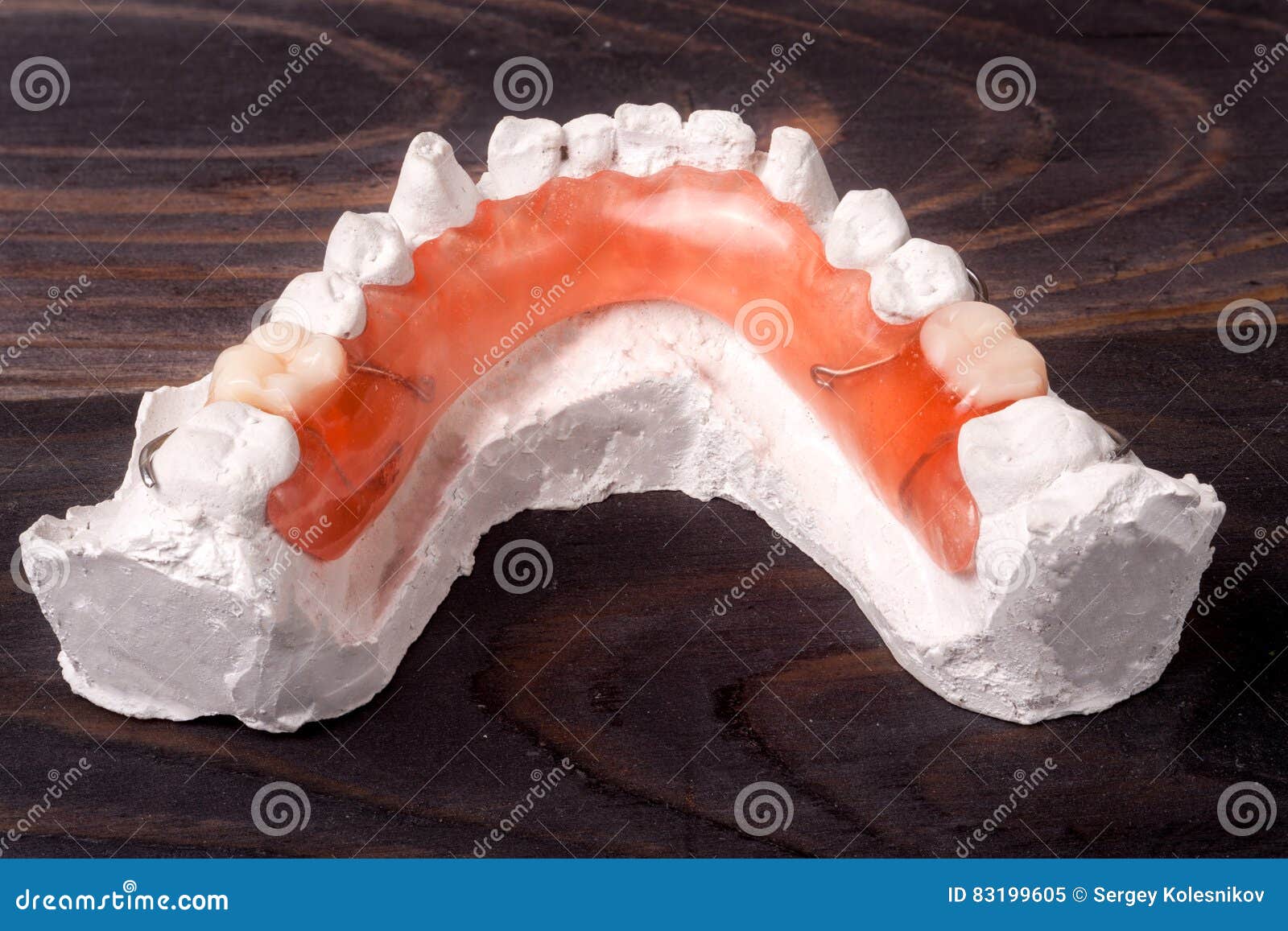 Plaster Cast of Teeth with Removable Partial Denture on a Dark Wooden ...