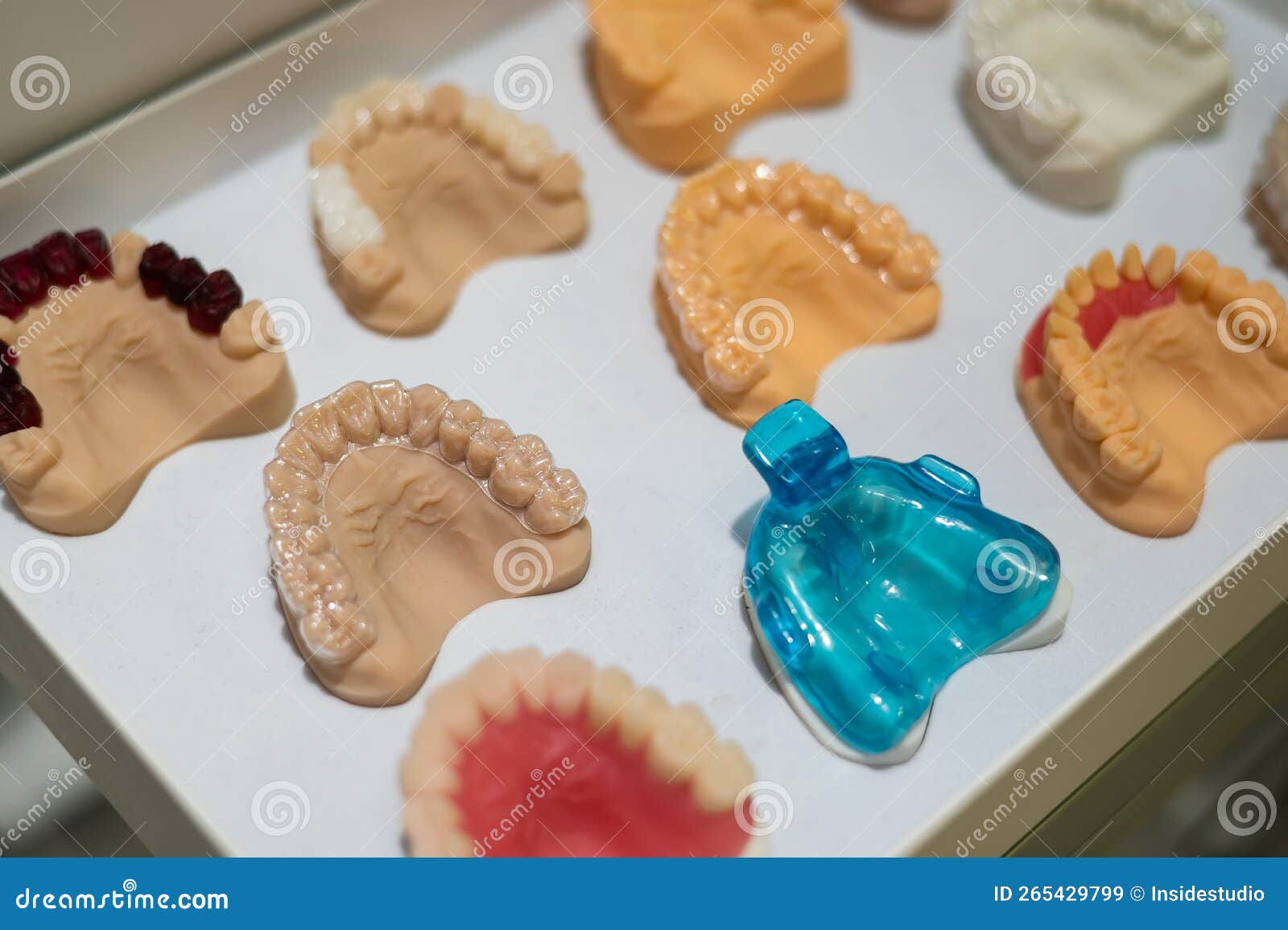 Plaster Casts of the Jaws. Variety of Samples in the Prosthetic ...