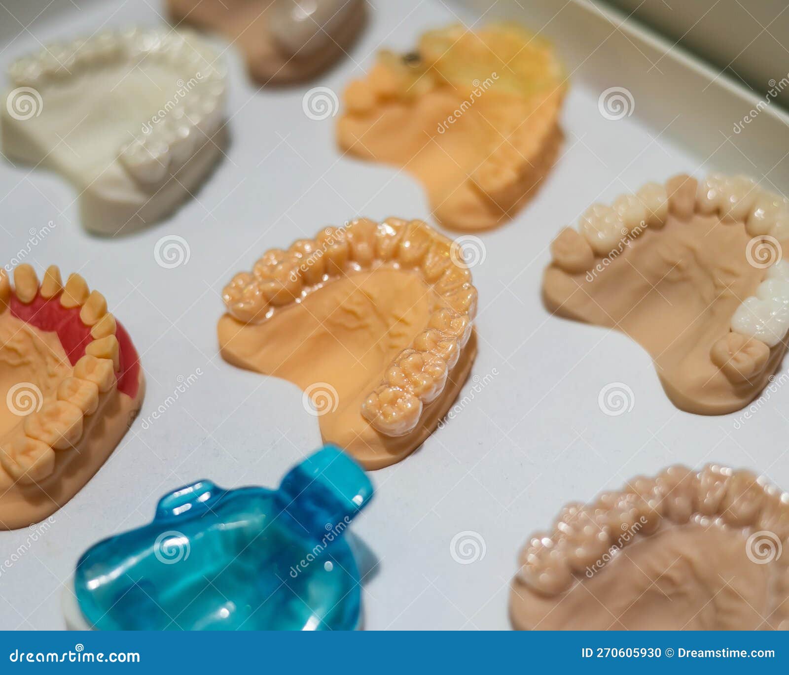 Plaster Casts of the Jaws. Variety of Samples in the Prosthetic ...