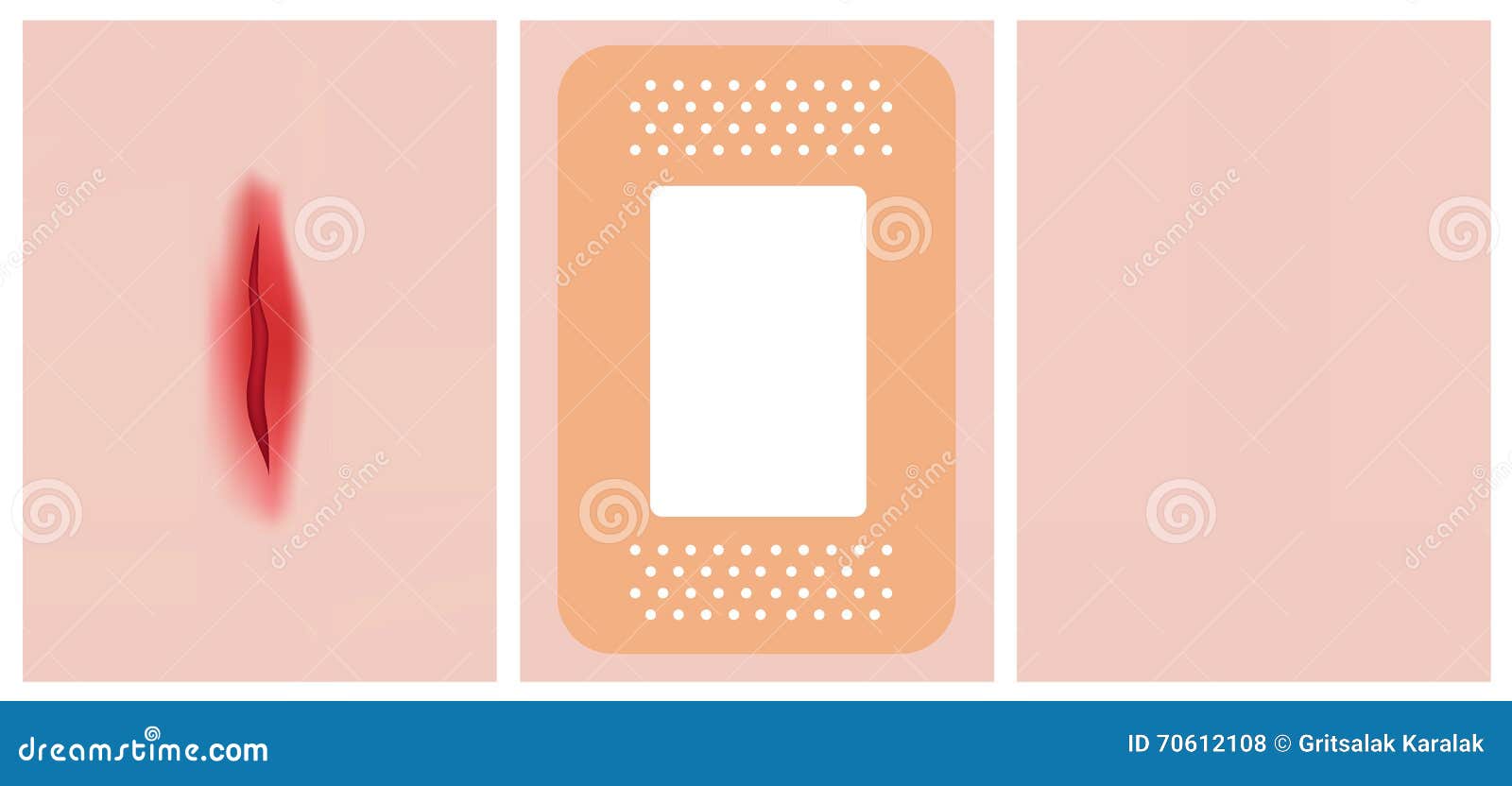 Plaster cure a wound stock illustration. Illustration of plaster - 70612108