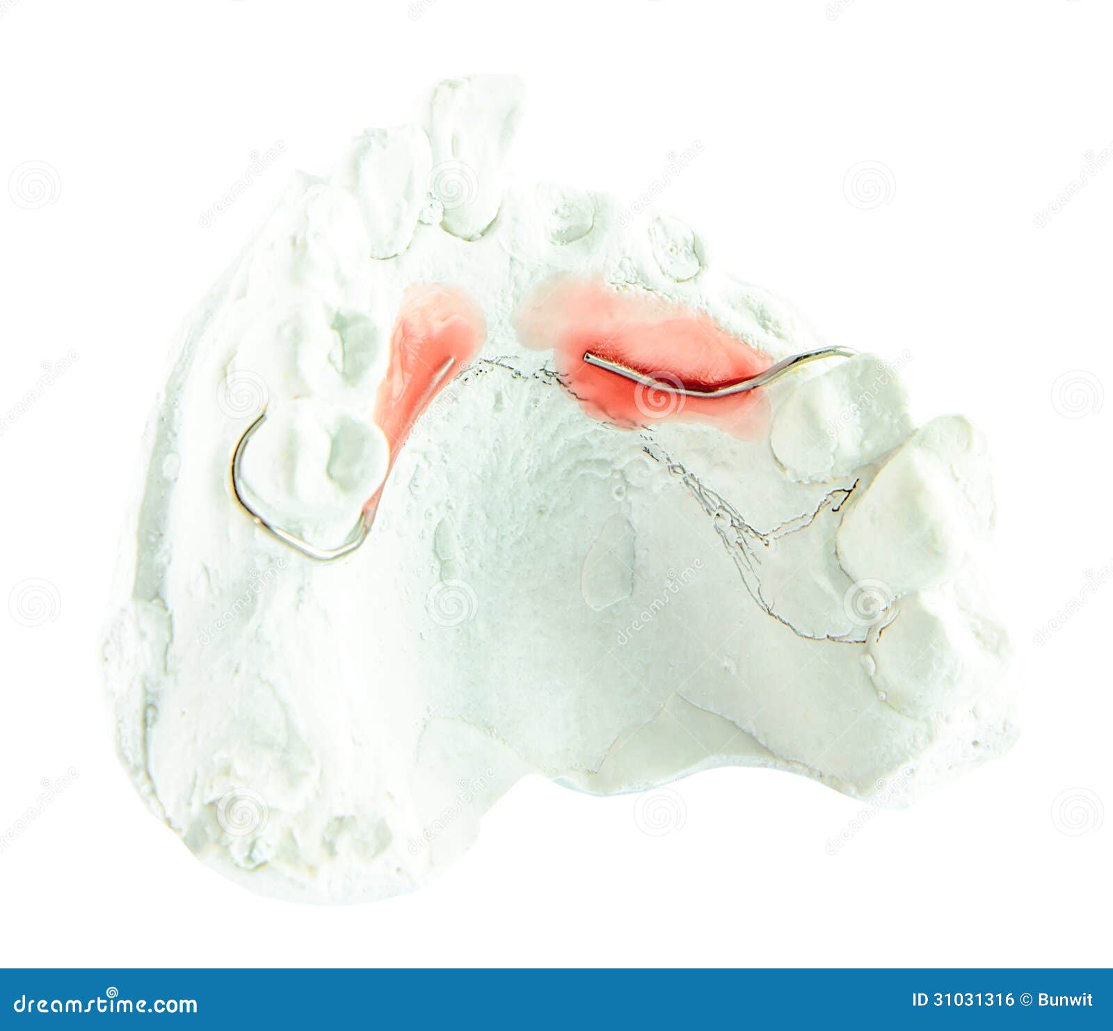 Plaster Denture Model with Wire for Make Denture Stock Photo - Image of ...