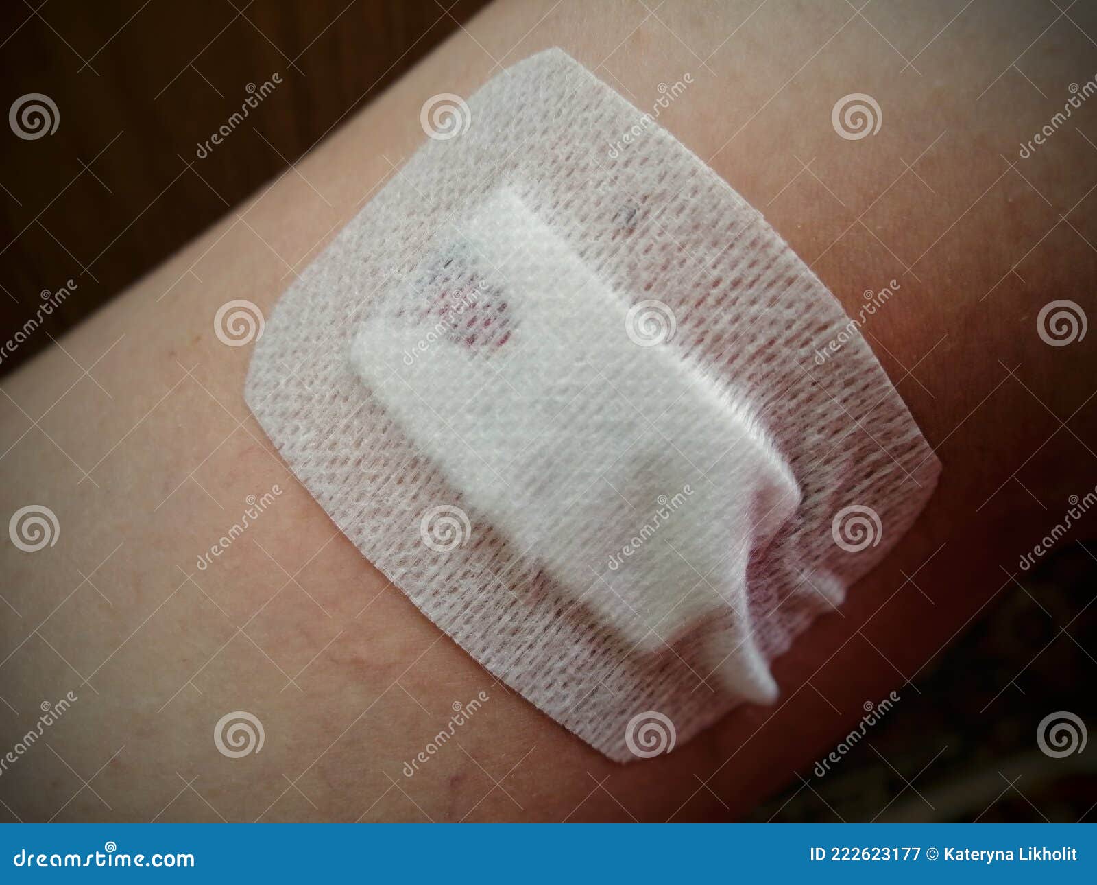 Plaster on a Fresh Wound, Scar, Blood Stock Image - Image of crochet ...