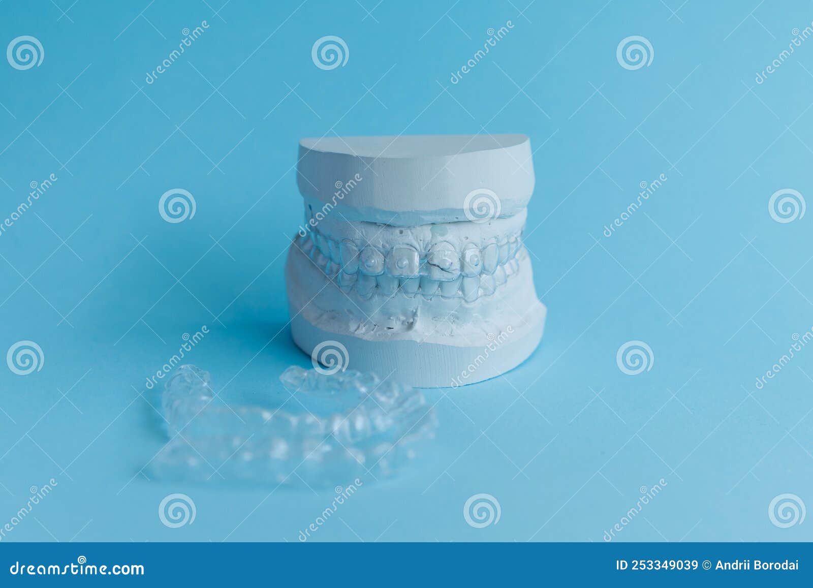 Plaster Human Jaw Model and Essix Retainer for Dental Correction. Stock ...