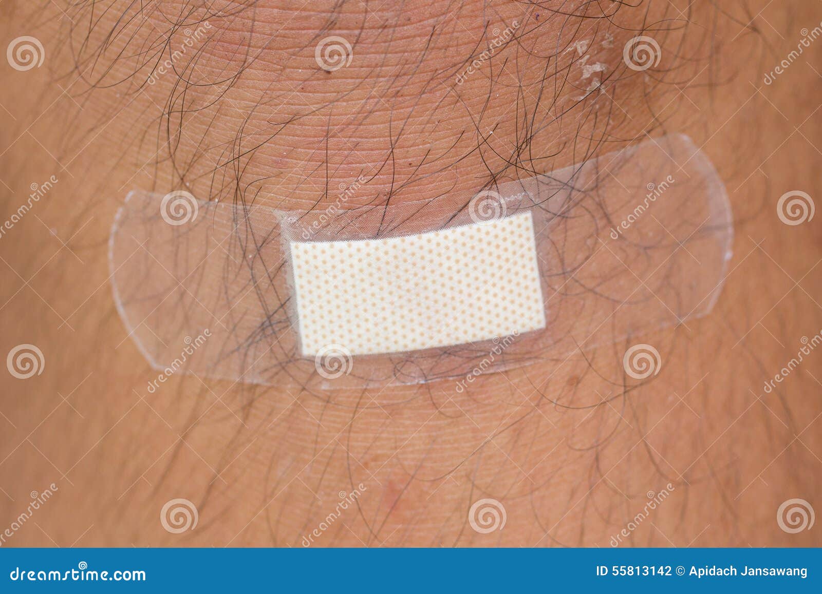 Plaster on the Injured Leg. Stock Photo - Image of crossing, protect ...