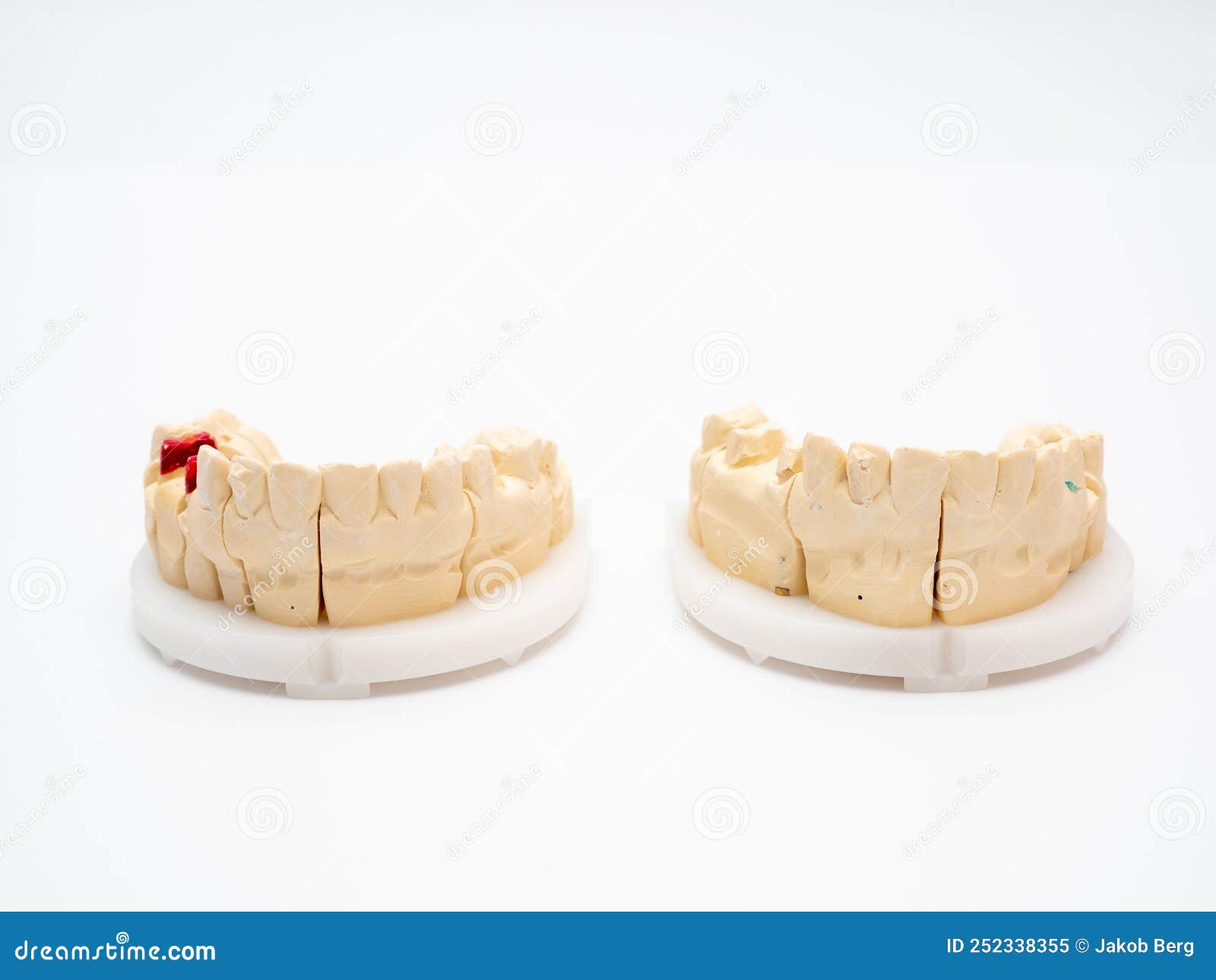 Plaster Model or Cast of Human Teeth. Stock Image - Image of cast ...