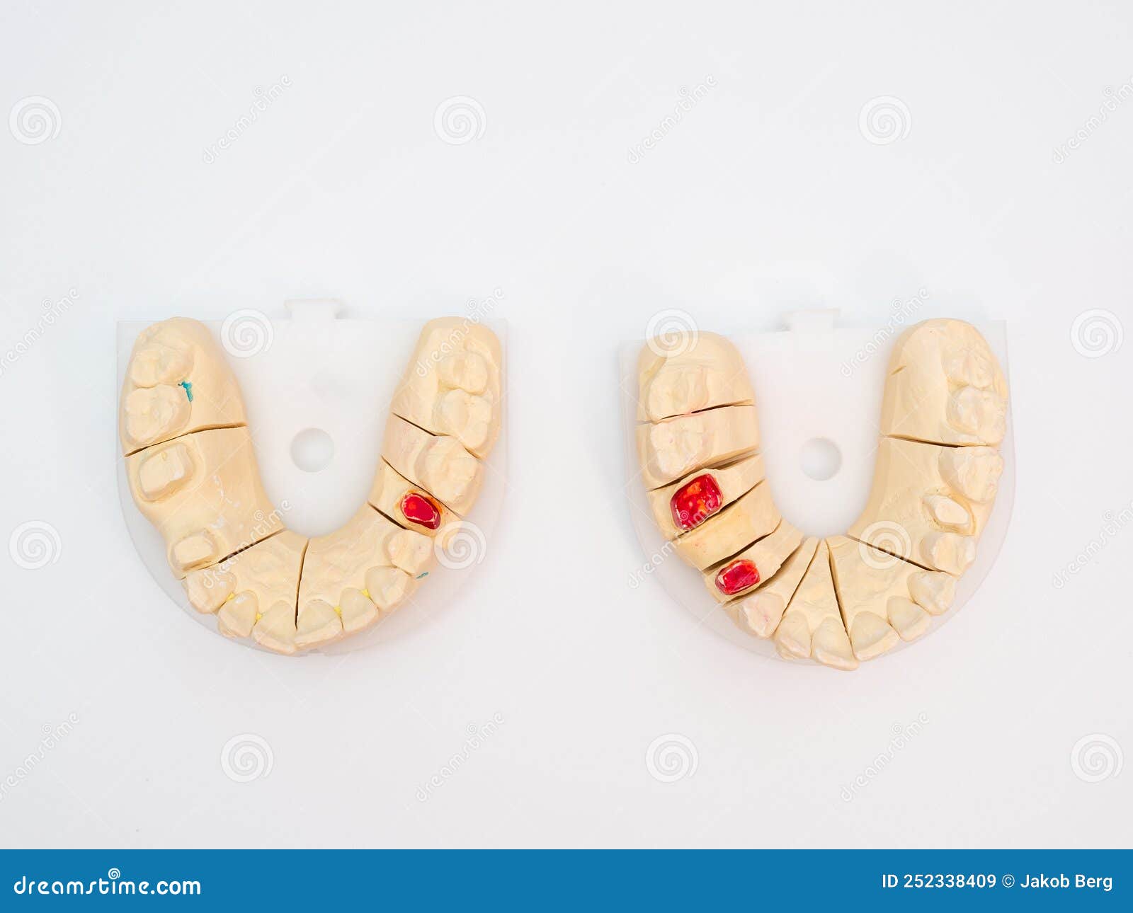 Plaster Model or Cast of Human Teeth. Stock Image - Image of anatomy ...