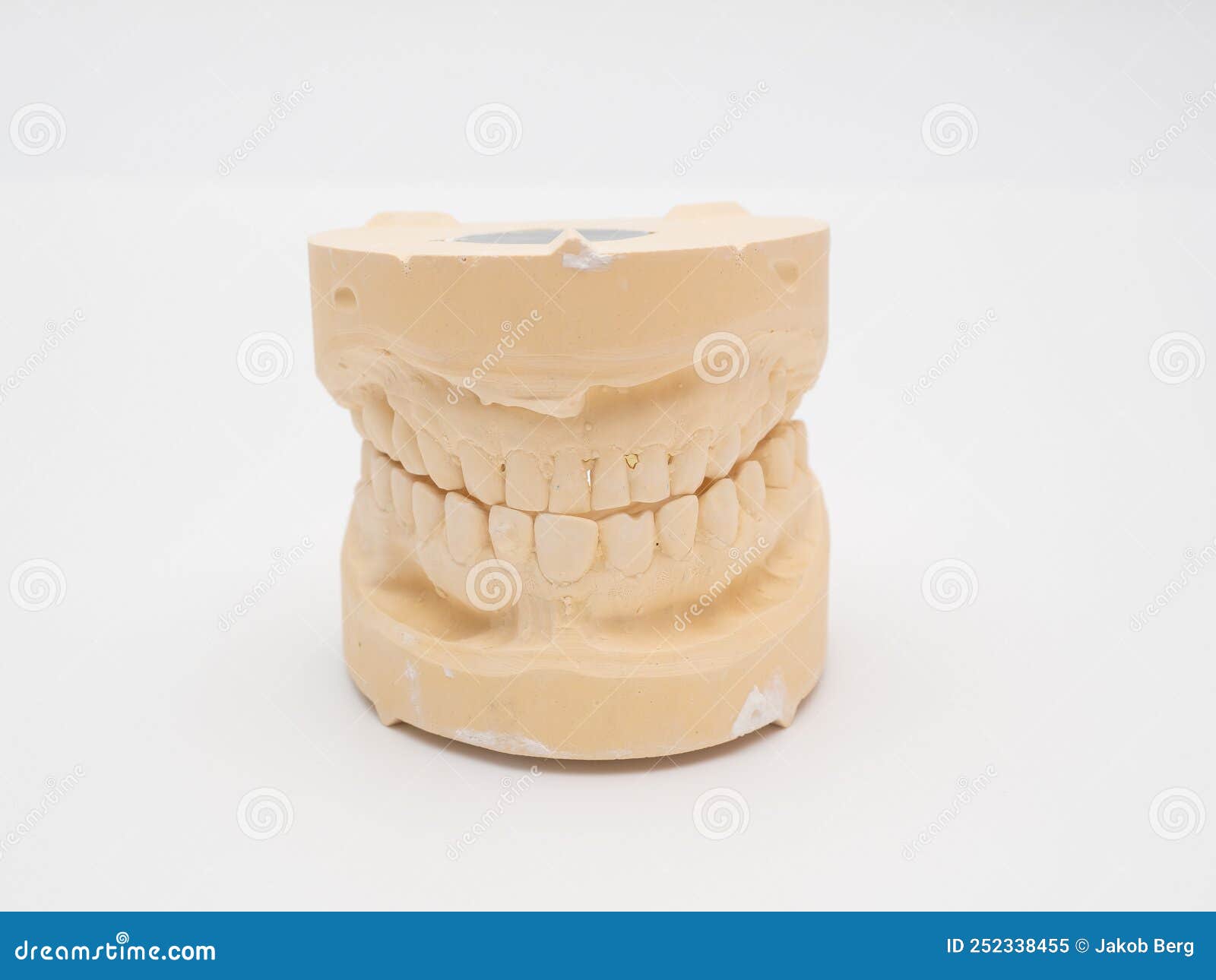 Plaster Model or Cast of Human Teeth. Stock Image - Image of oral ...