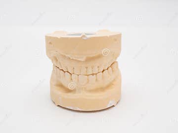 Plaster Model or Cast of Human Teeth. Stock Image - Image of oral ...