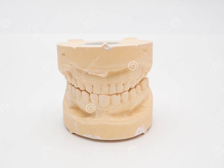 Plaster Model or Cast of Human Teeth. Stock Image - Image of oral ...