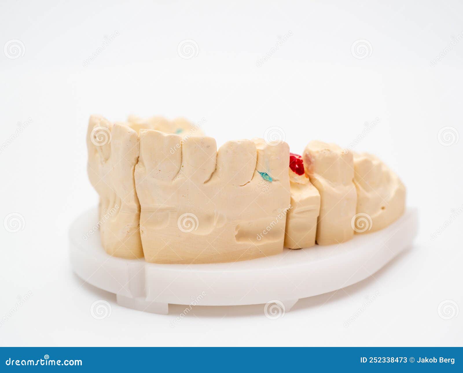 Plaster Model or Cast of Human Teeth. Stock Image - Image of equipment ...