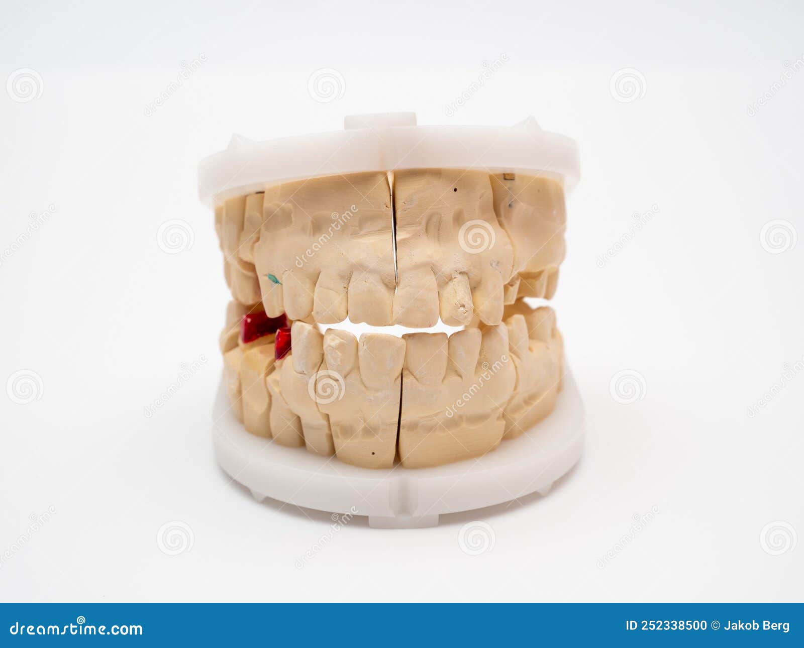 Plaster Model or Cast of Human Teeth. Stock Photo - Image of model ...