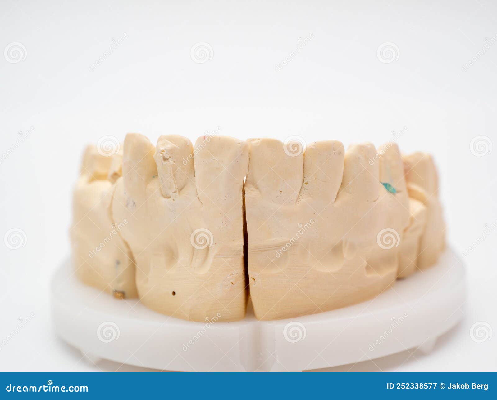 Plaster Model or Cast of Human Teeth. Stock Image - Image of cast ...