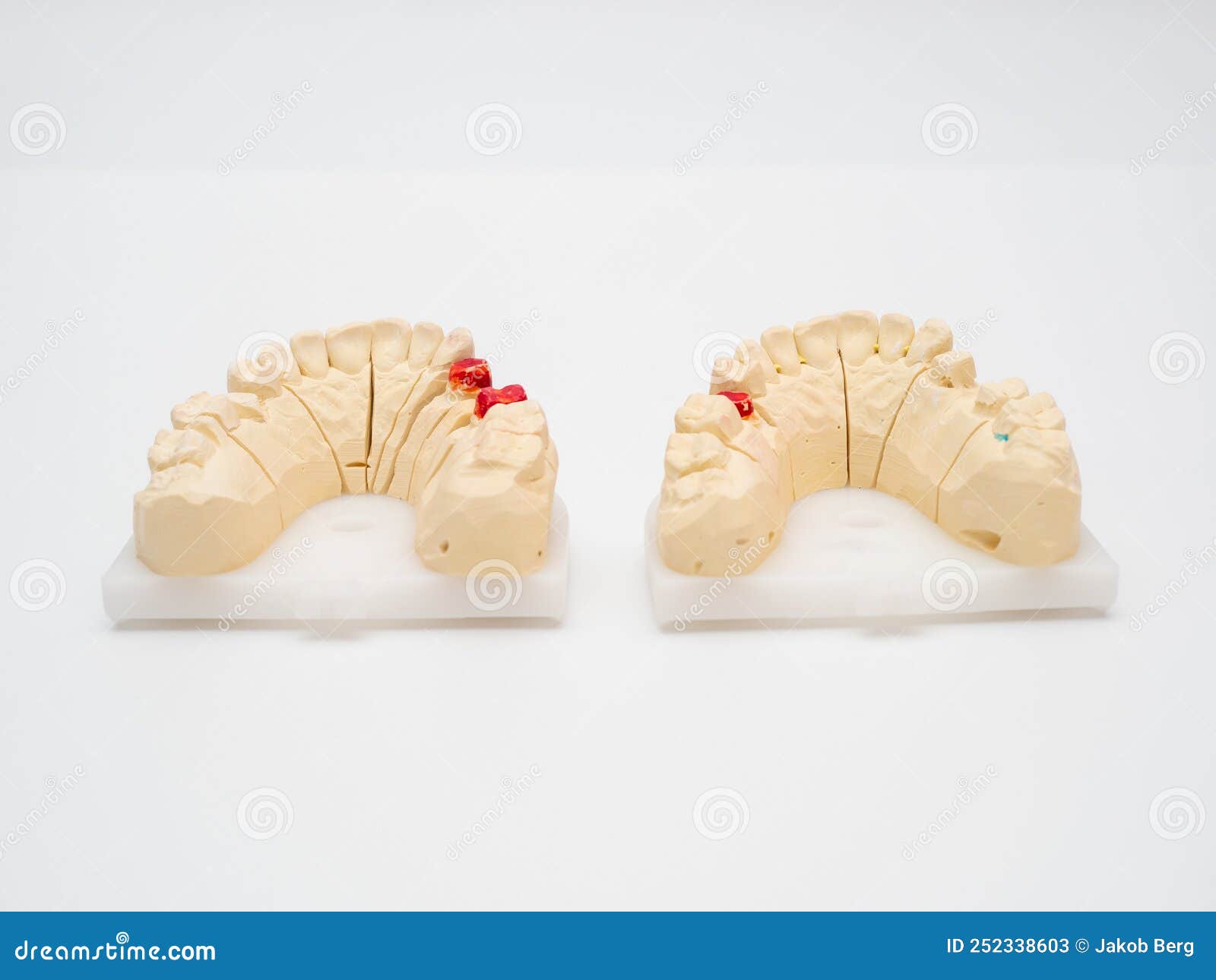 Plaster Model or Cast of Human Teeth. Stock Image - Image of equipment ...