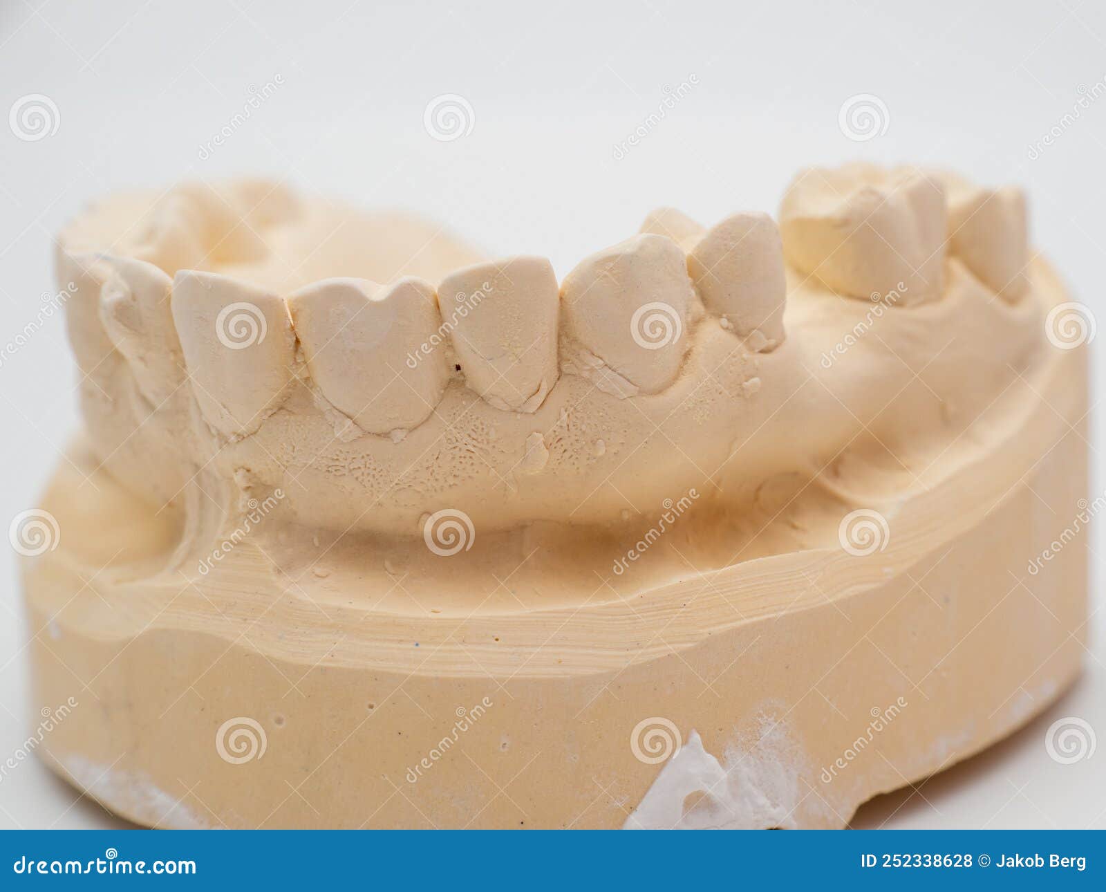 Plaster Model or Cast of Human Teeth. Stock Photo - Image of prosthesis ...