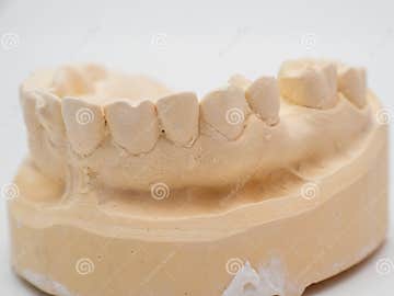 Plaster Model or Cast of Human Teeth. Stock Photo - Image of prosthesis ...