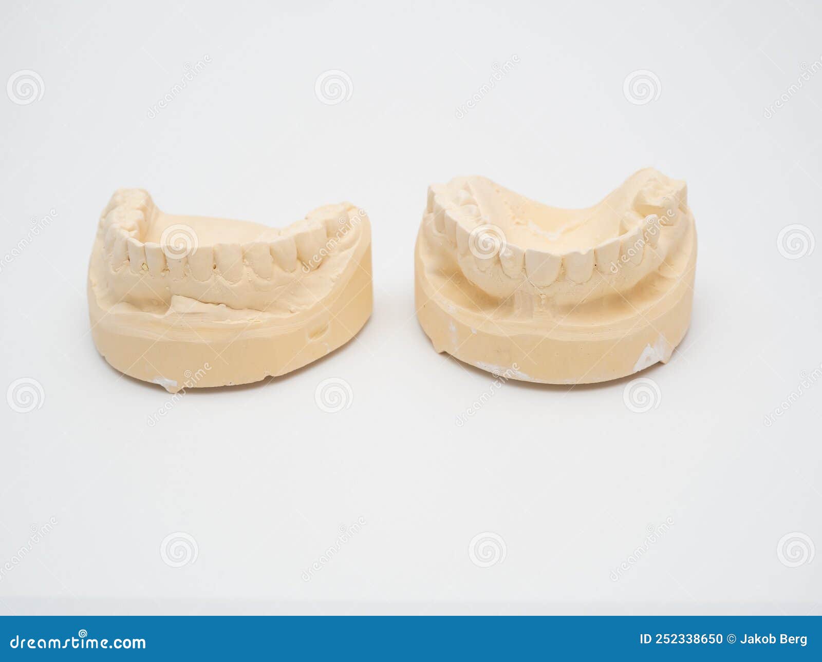 Plaster Model or Cast of Human Teeth. Stock Photo - Image of plaster ...