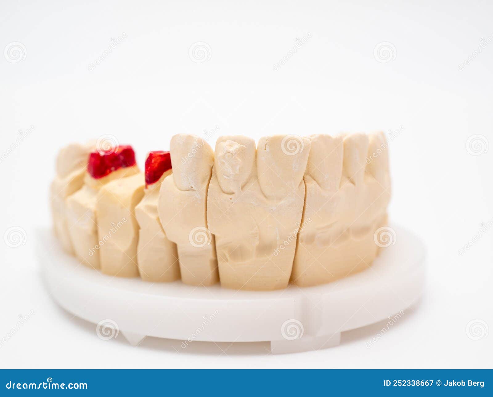 Plaster Model or Cast of Human Teeth. Stock Image - Image of tooth ...