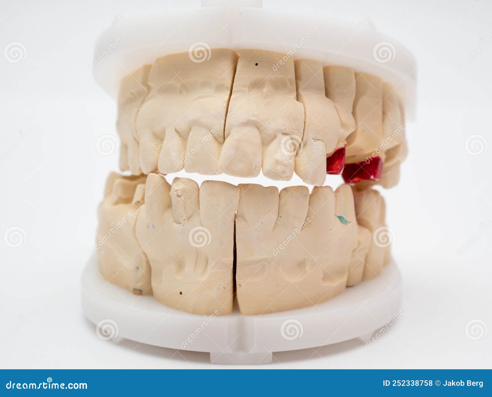 Plaster Model or Cast of Human Teeth. Stock Photo - Image of dental ...