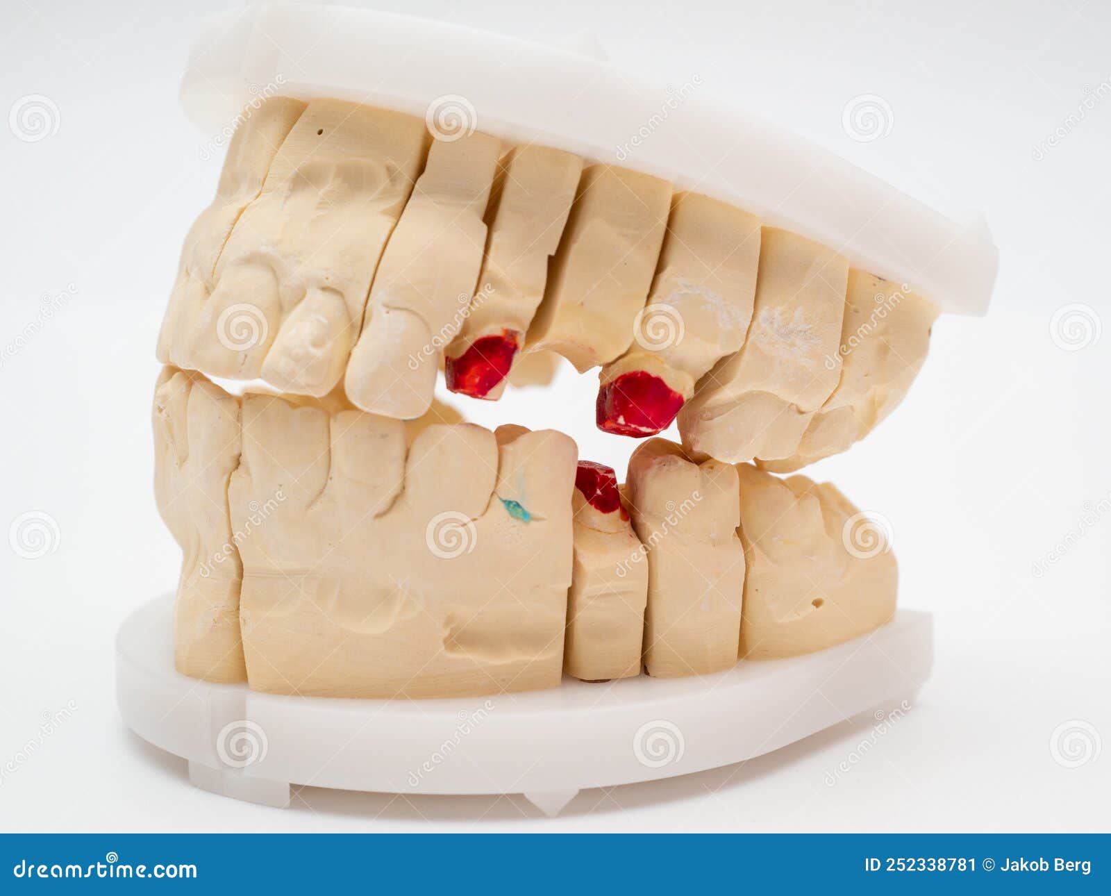 Plaster Model or Cast of Human Teeth. Stock Image - Image of human ...