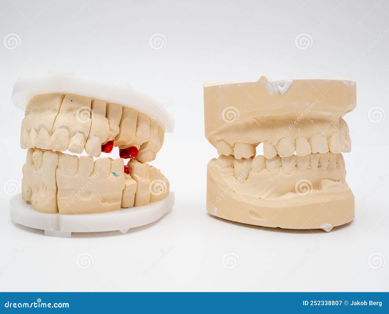 Plaster Model Or Cast Of Human Teeth. Royalty-Free Stock Photography ...
