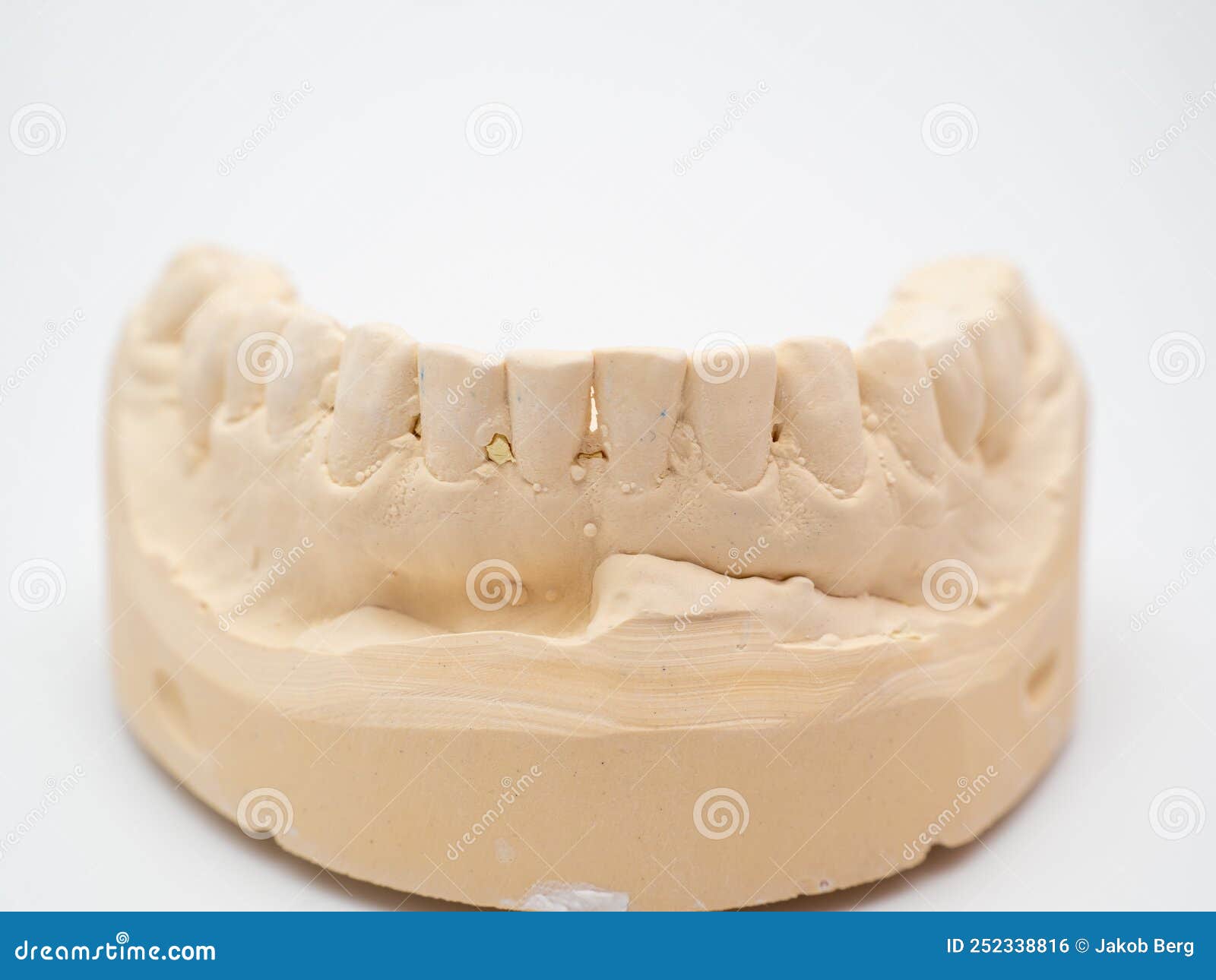 Plaster Model or Cast of Human Teeth. Stock Photo - Image of crown ...