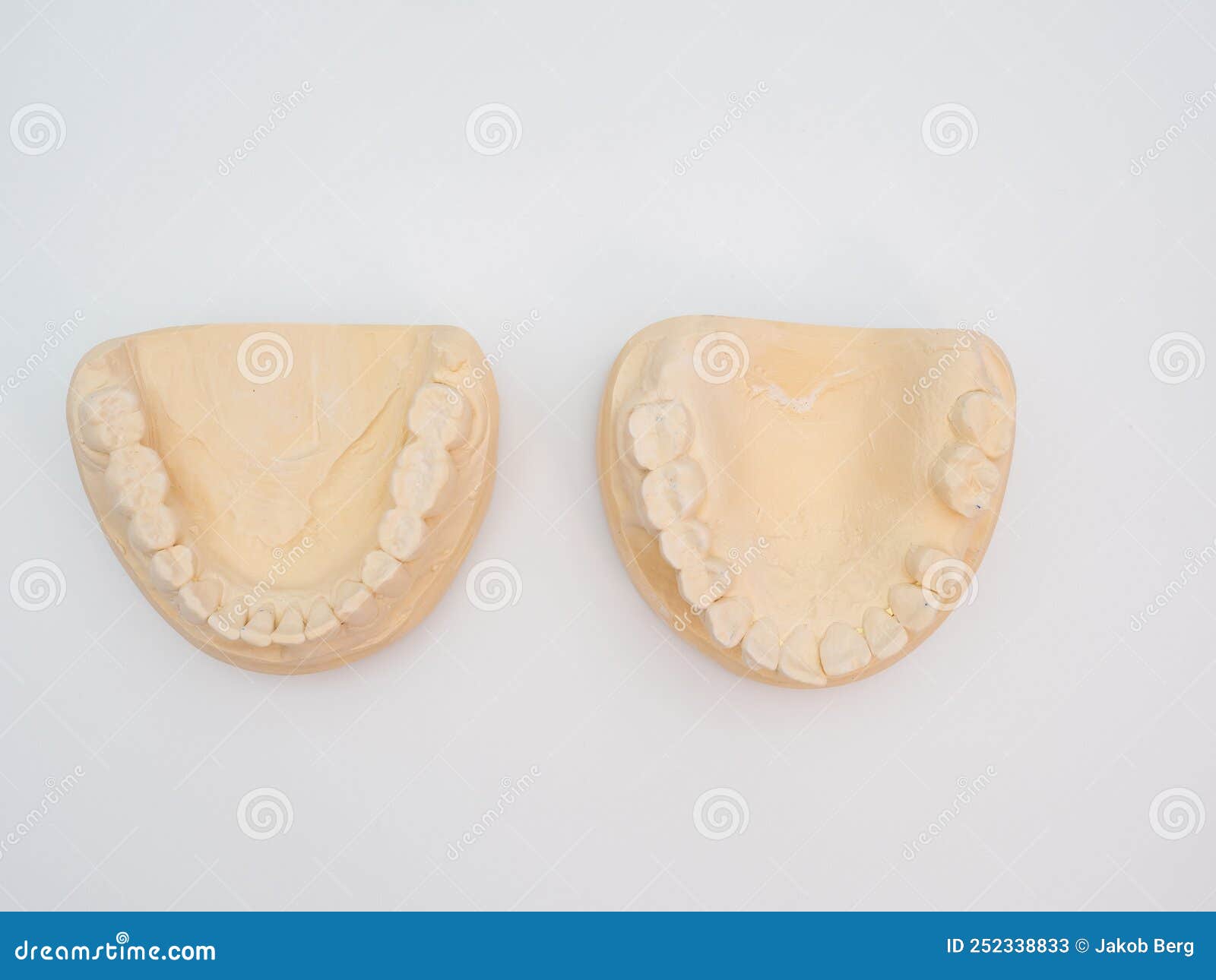 Plaster Model or Cast of Human Teeth. Stock Image - Image of dentist ...